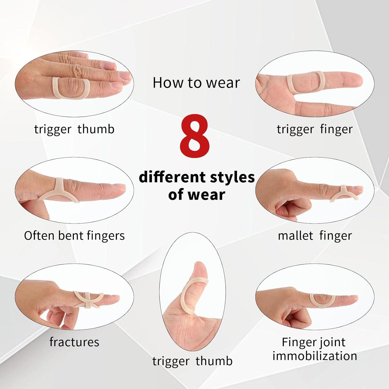 Oval Finger Splint Kit - 10 Pieces | Finger Support Brace for Trigger ...
