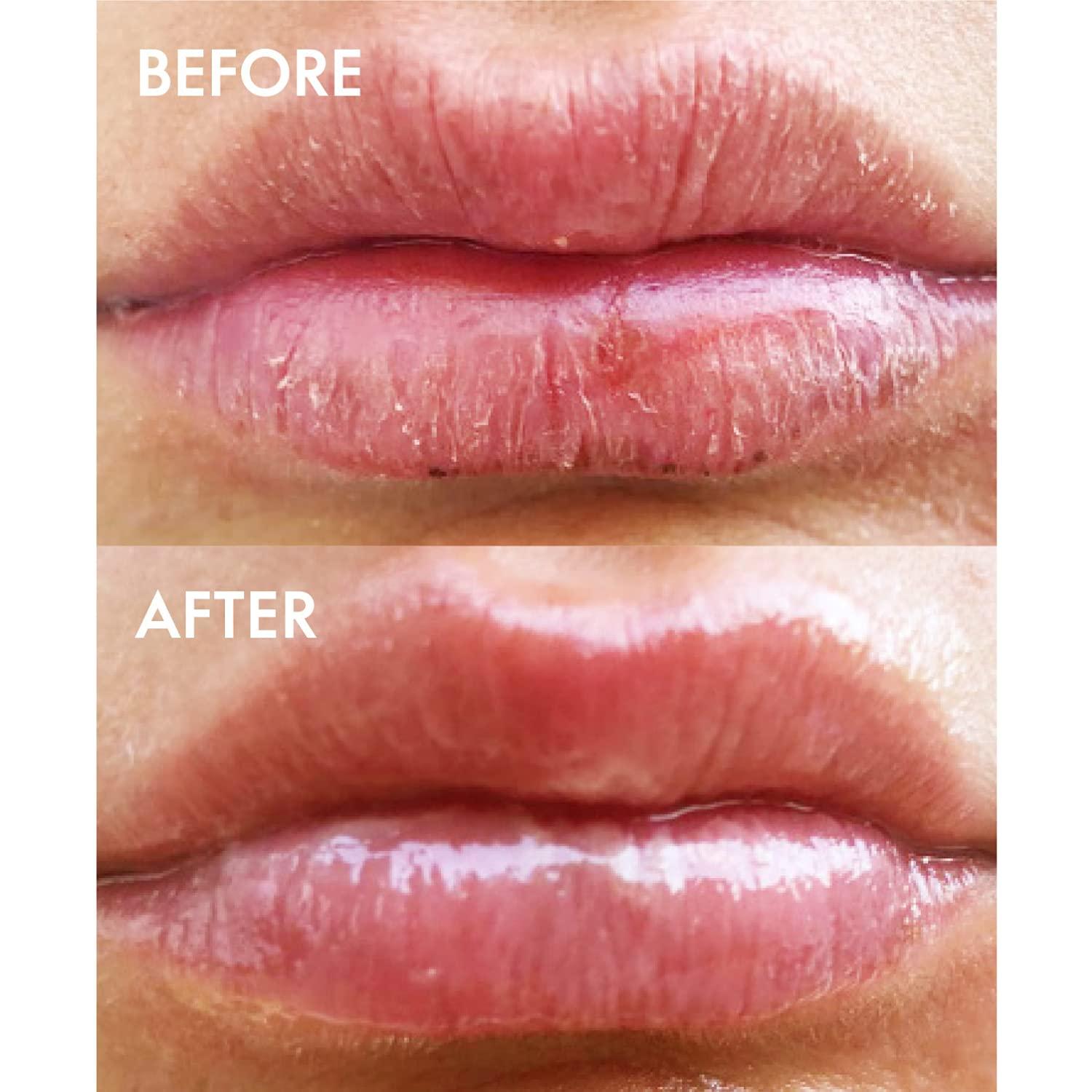 Lanolips Hydrate & Shimmer Bundle - 3-Piece Lanolin Balm Set for Lips ...