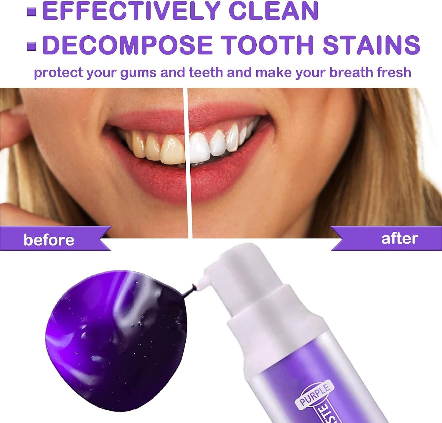 Purple Teeth Whitening Gel - Stain Removal & Sensitive Teeth Protection ...
