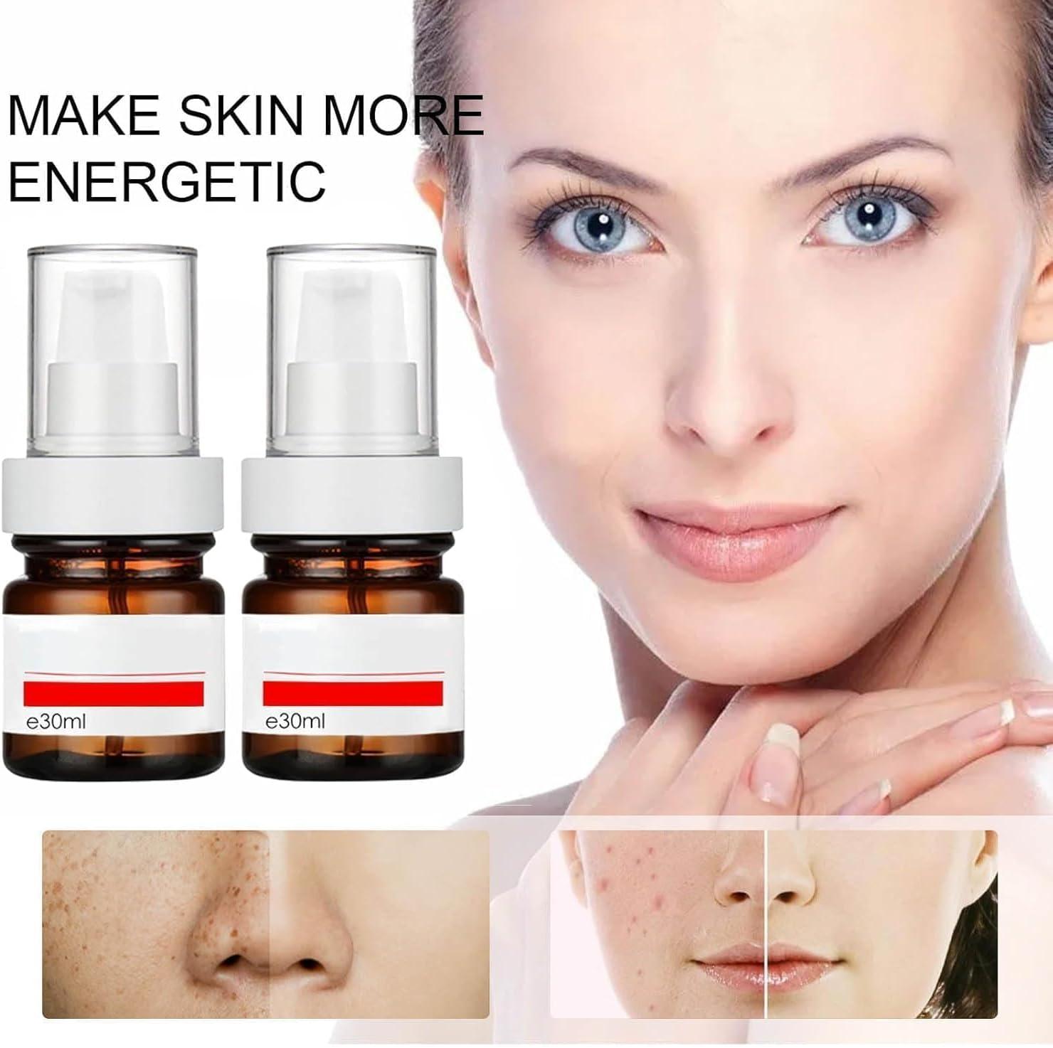 Aobenz Serum Aobenz Whitening and Freckle Removing Essence Aobenz Anti ...