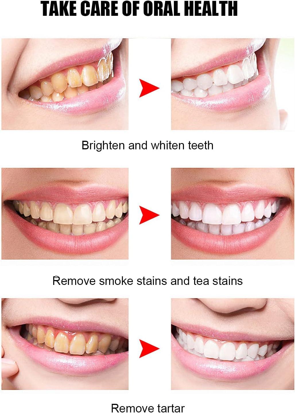 Electric Toothbrush Adults Portable Ultrasonic U-Shaped Toothbrushes ...