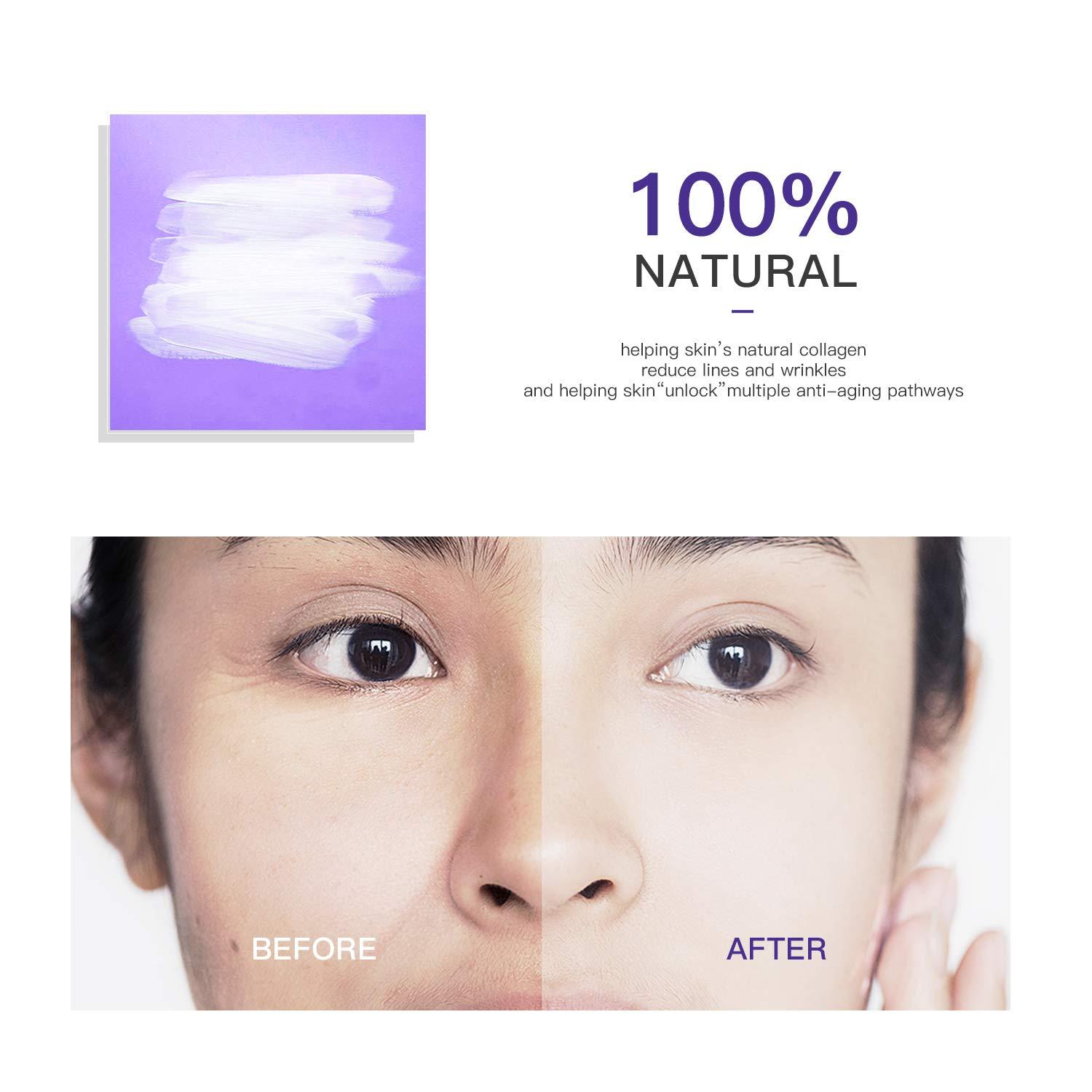 HOPEMATE Premium Retinol Cream 2.5% for Face & Eye Care - Anti-Aging ...