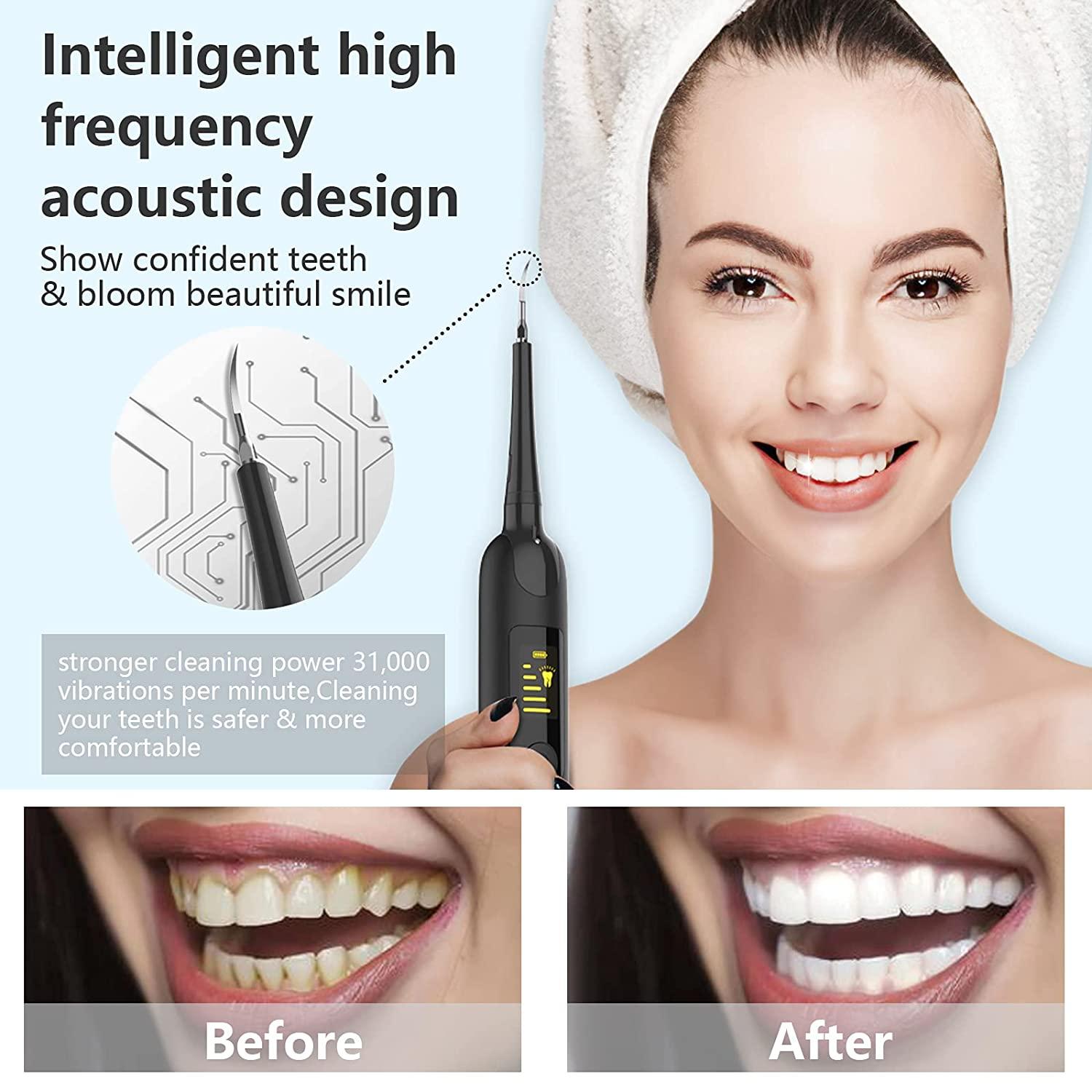 Electric Ultrasonic Plaque Dental Calculus Remover for Adults and Pets ...