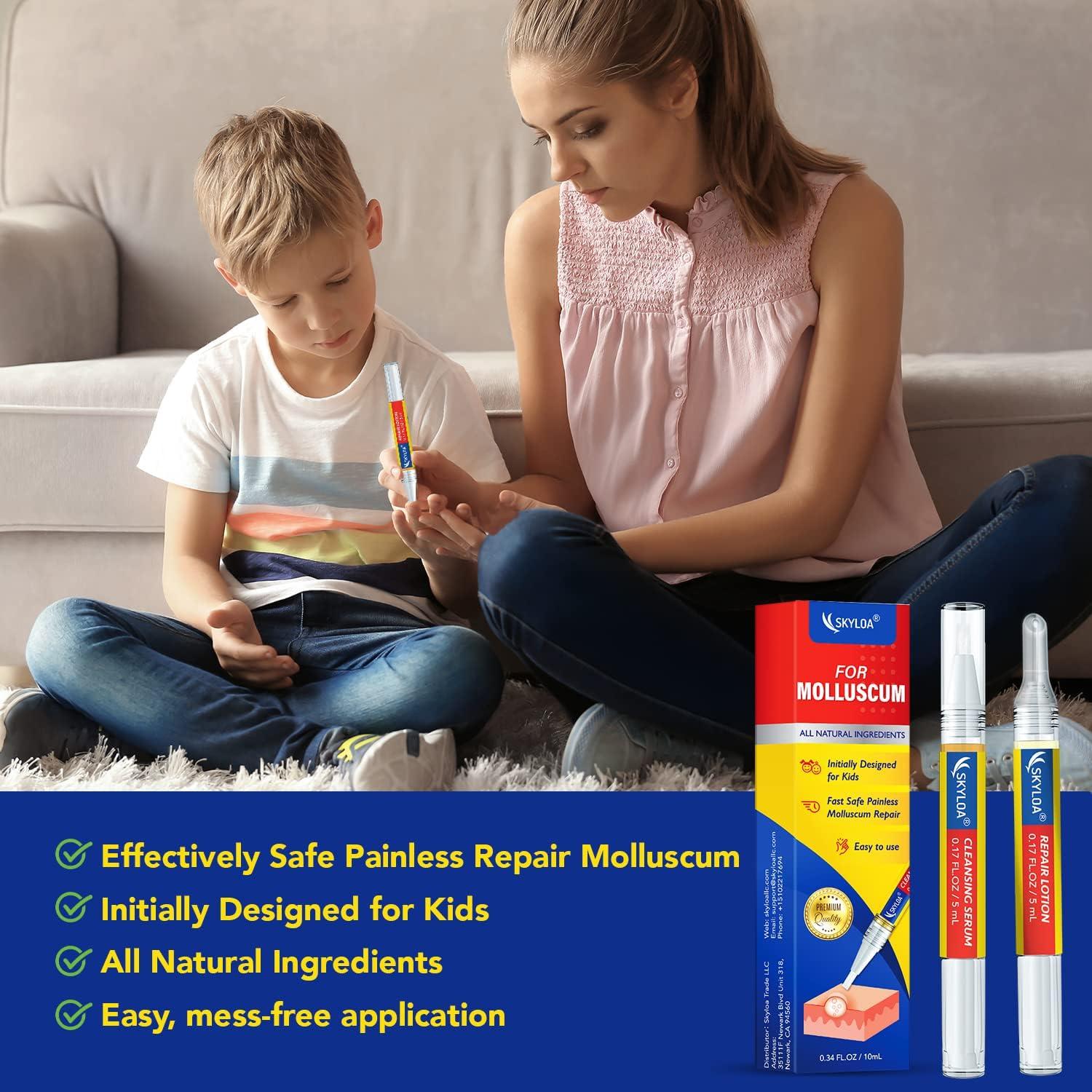 Skyloa Molluscum Contagiosum Treatment Pen | Safe & Painless Repair Kit ...