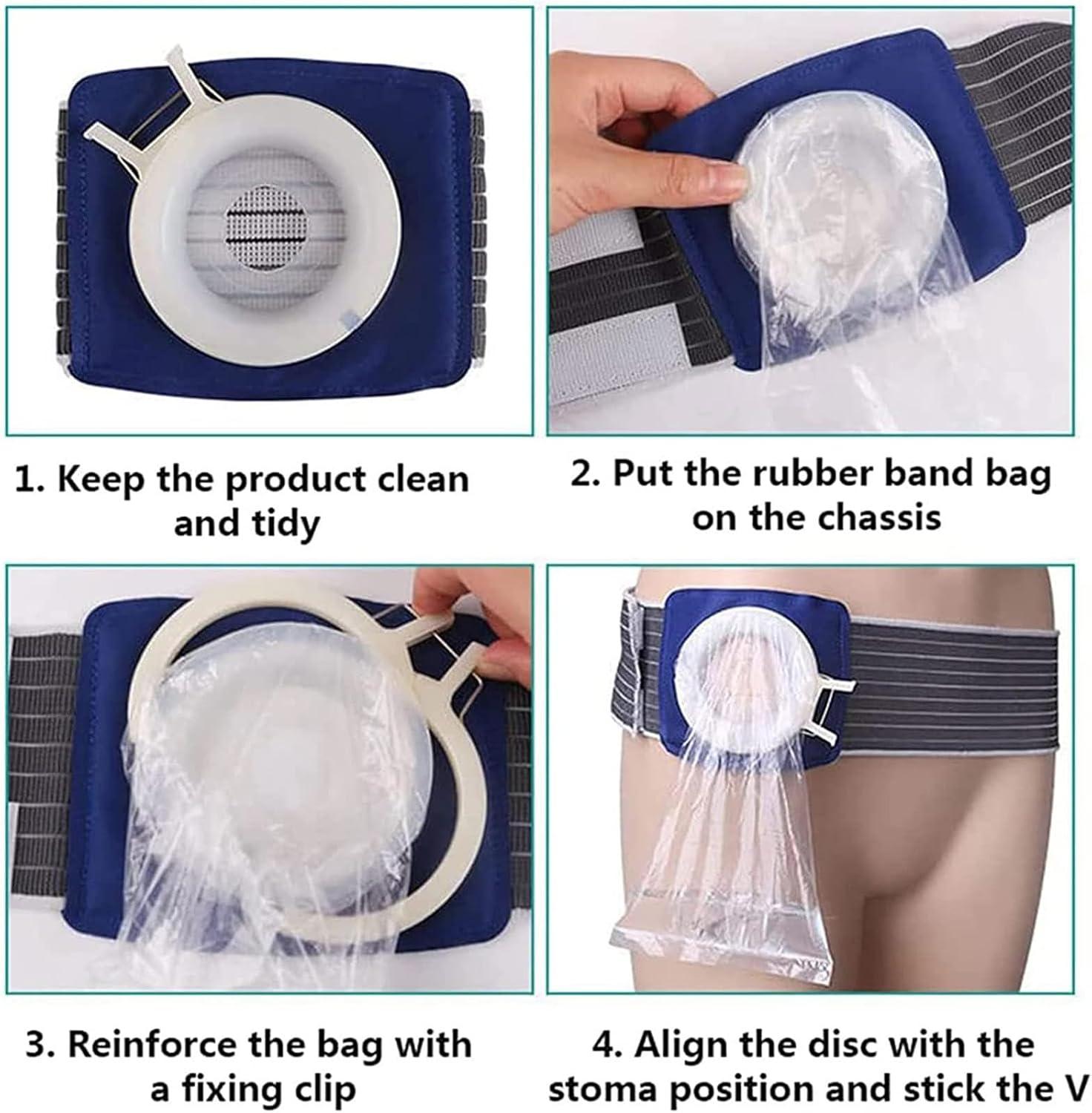 HEAXIY Stoma Support Belt for Colostomy Patients - Prevents Parastomal ...