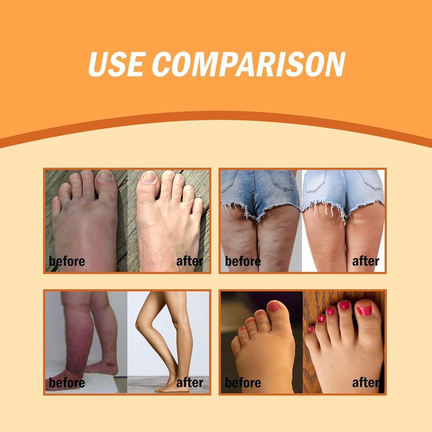 Gingerlegs Anti-Swelling Ointment Det_oxing Anti-Swelling Ointment ...