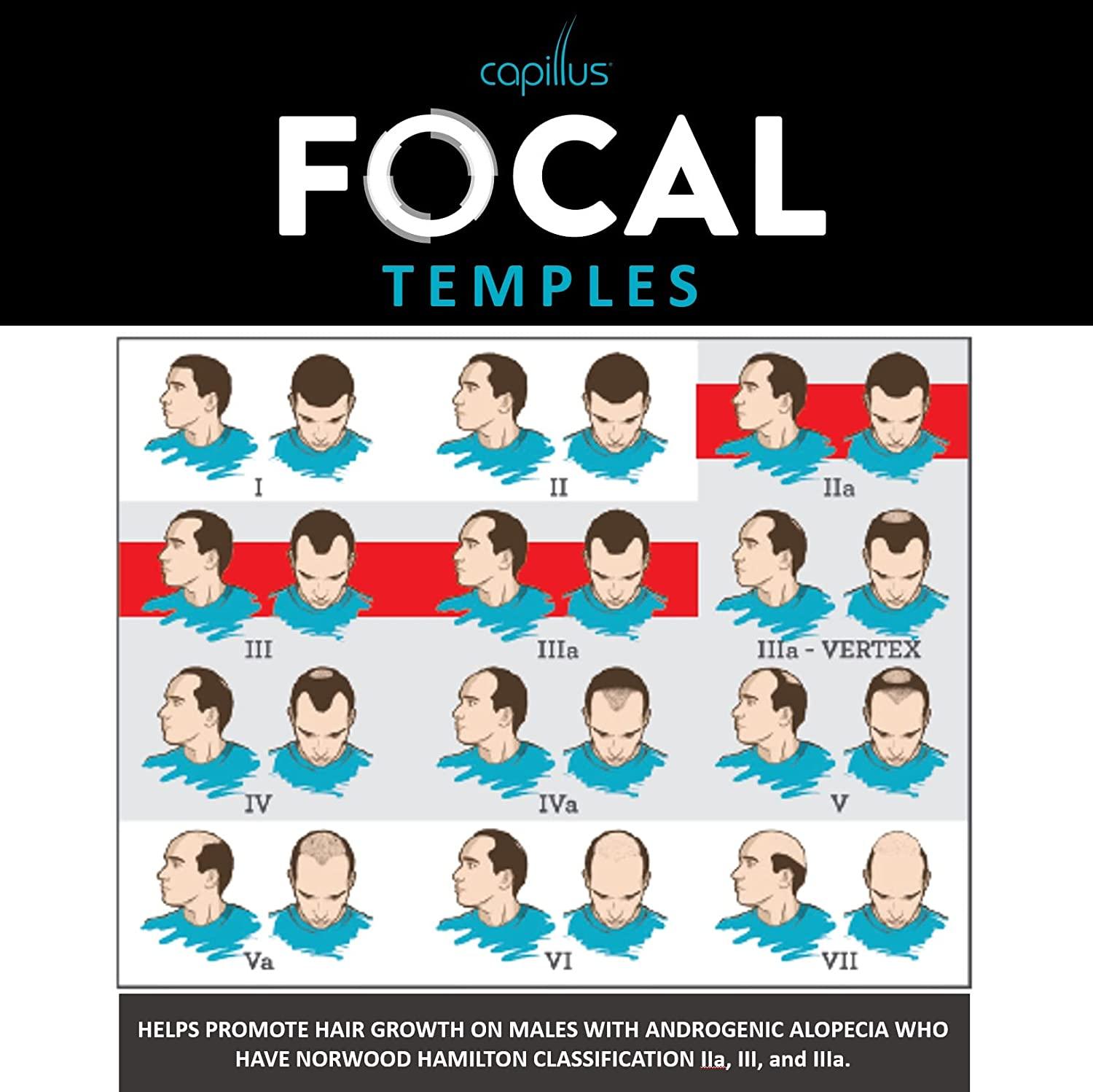 Capillus FOCAL TEMPLES Hair Laser Growth Cap for Men - FDA Cleared ...