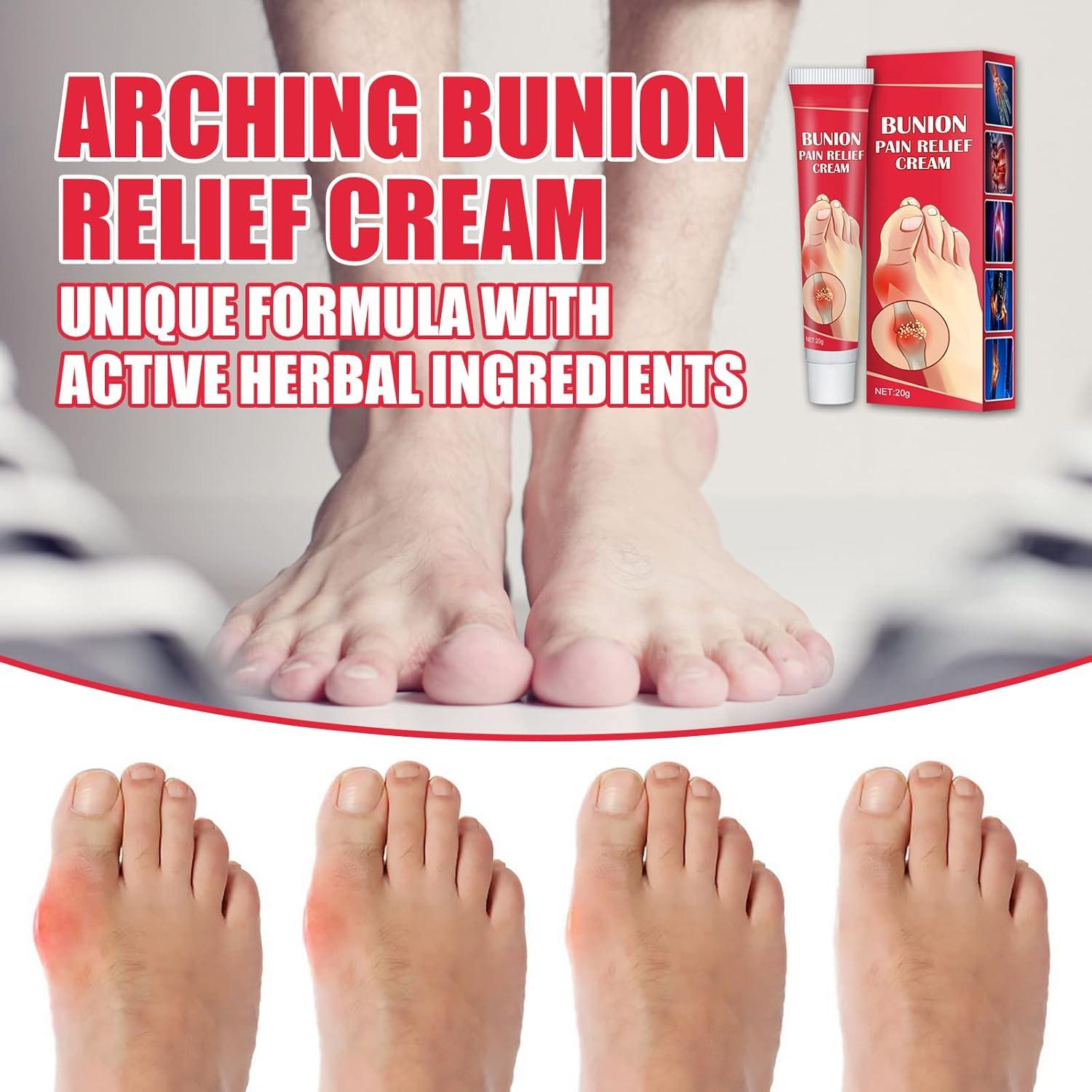 Bunion Pain Relief Cream - Soothing Bunion Relief & Inflammation ...