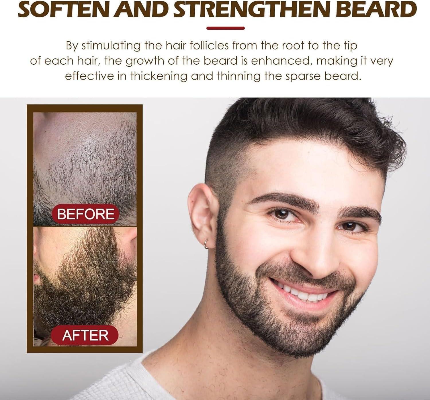 3 Pieces of Natural Beard Growth Bio-Care Oil | Promote Facial Hair ...