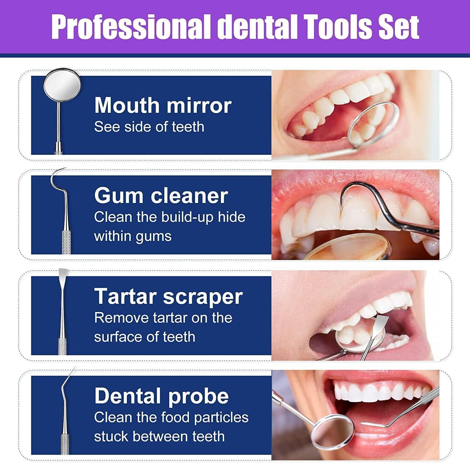 EXQST Restoration Pearl Teeth Kit - Dental Restoration for Missing ...