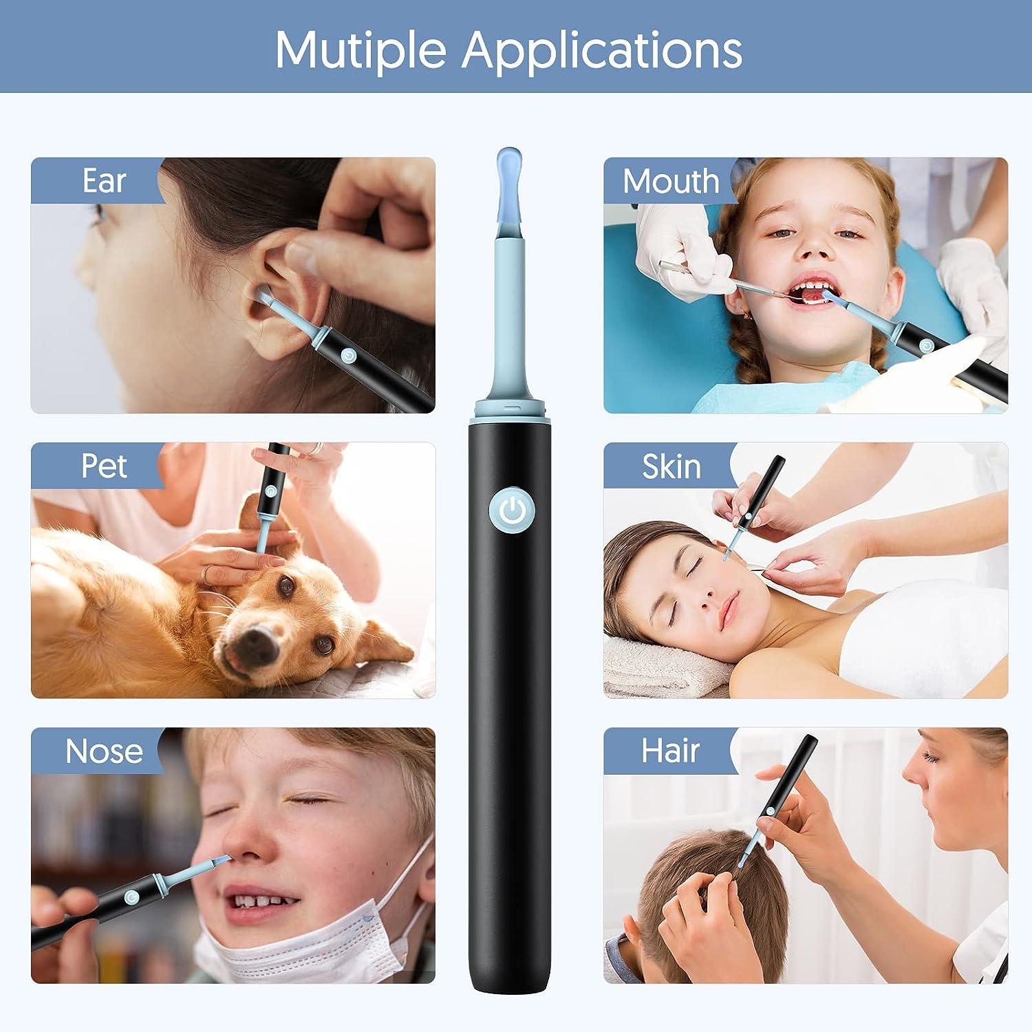 1920P FHD Ear Wax Removal Kit Camera - Portable Ear Cleaner with 6 LED ...