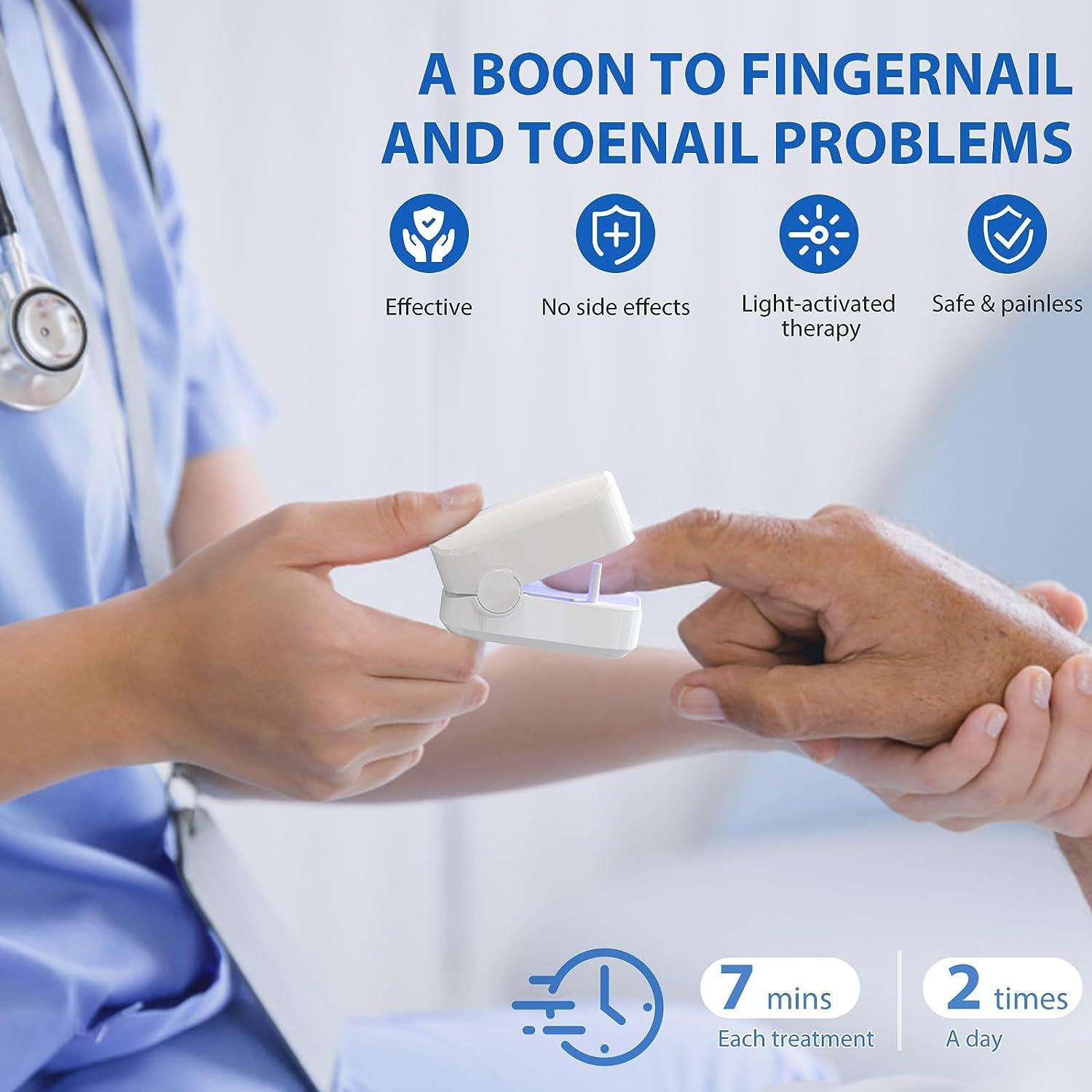 Nail Fungus Treatment Kit - Laser Device for Onychomycosis & Ingrown ...