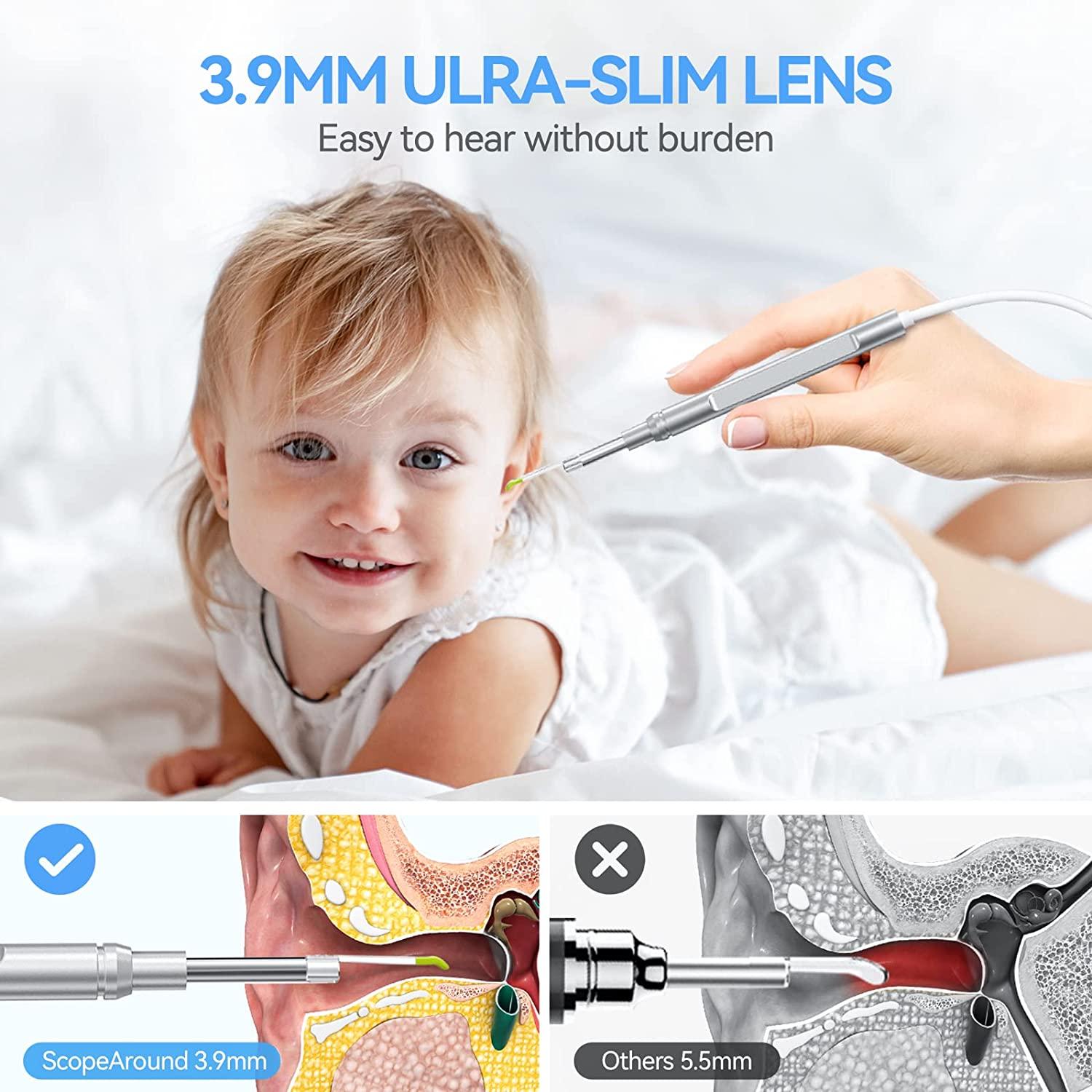 ScopeAround Ear Wax Removal Camera - 4.5 IPS Screen, 1920x1080 FHD ...