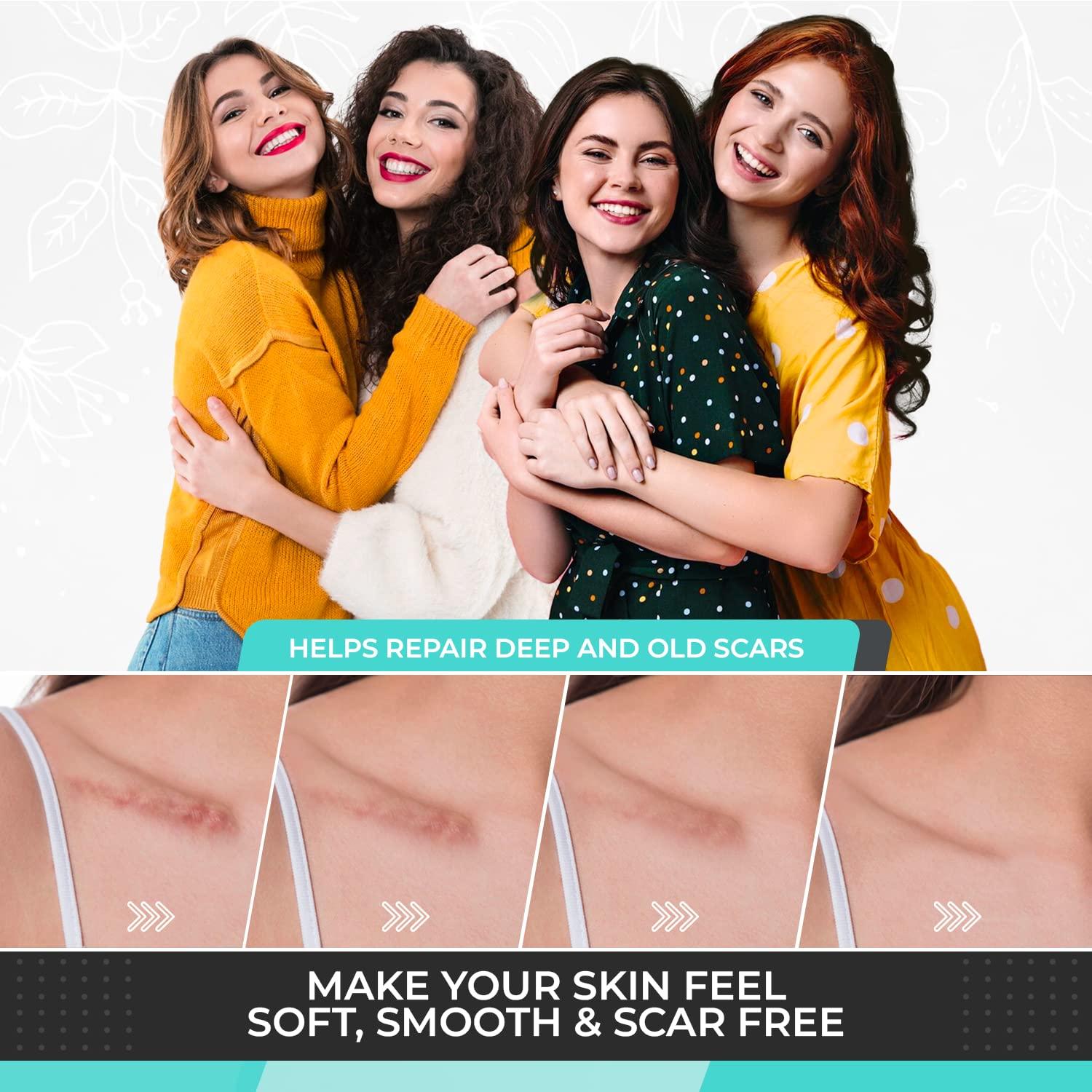 Scar Removal Cream with Collagen, Snail Extract, Vitamin E - Face ...