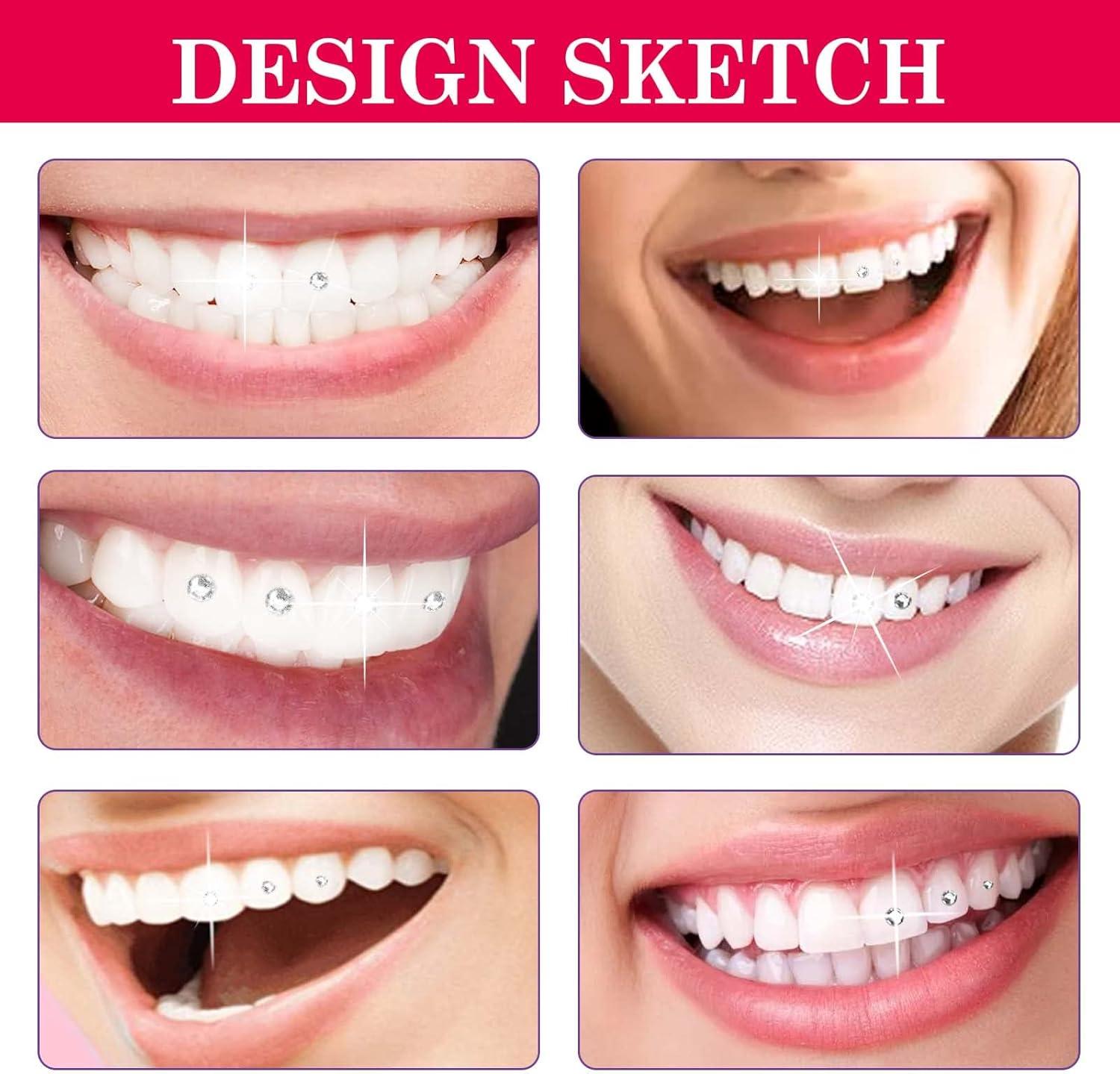 Tooth Gemstone Set | DIY Teeth Gems Kit with Glue | Tooth Jewelry ...