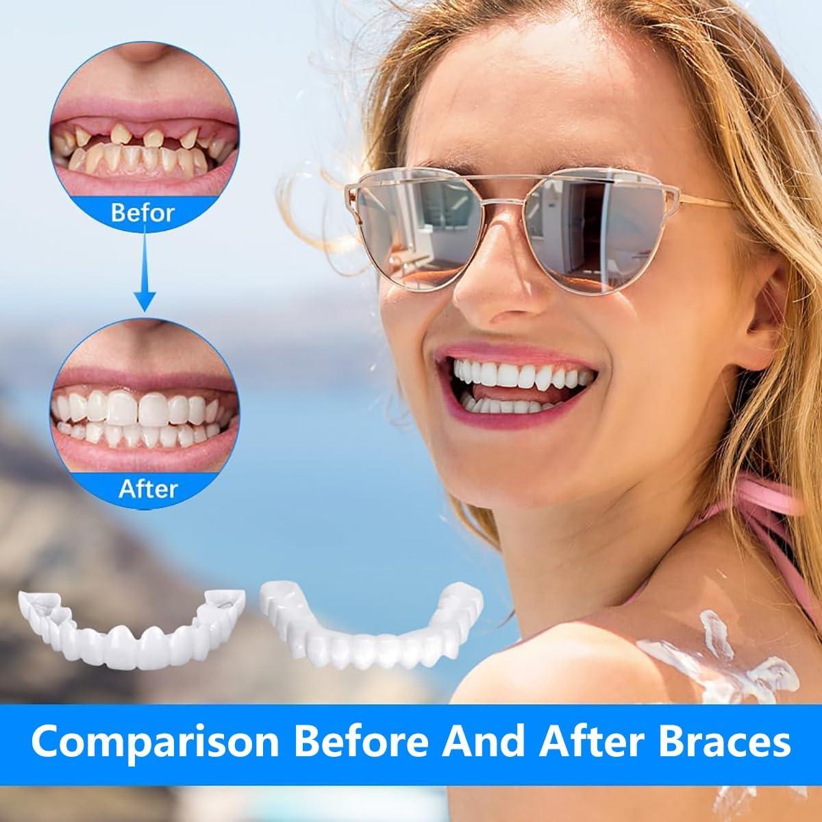 Dazzluxe 2-Piece Adjustable Tooth Veneers - DIY Cosmetic Teeth for a ...