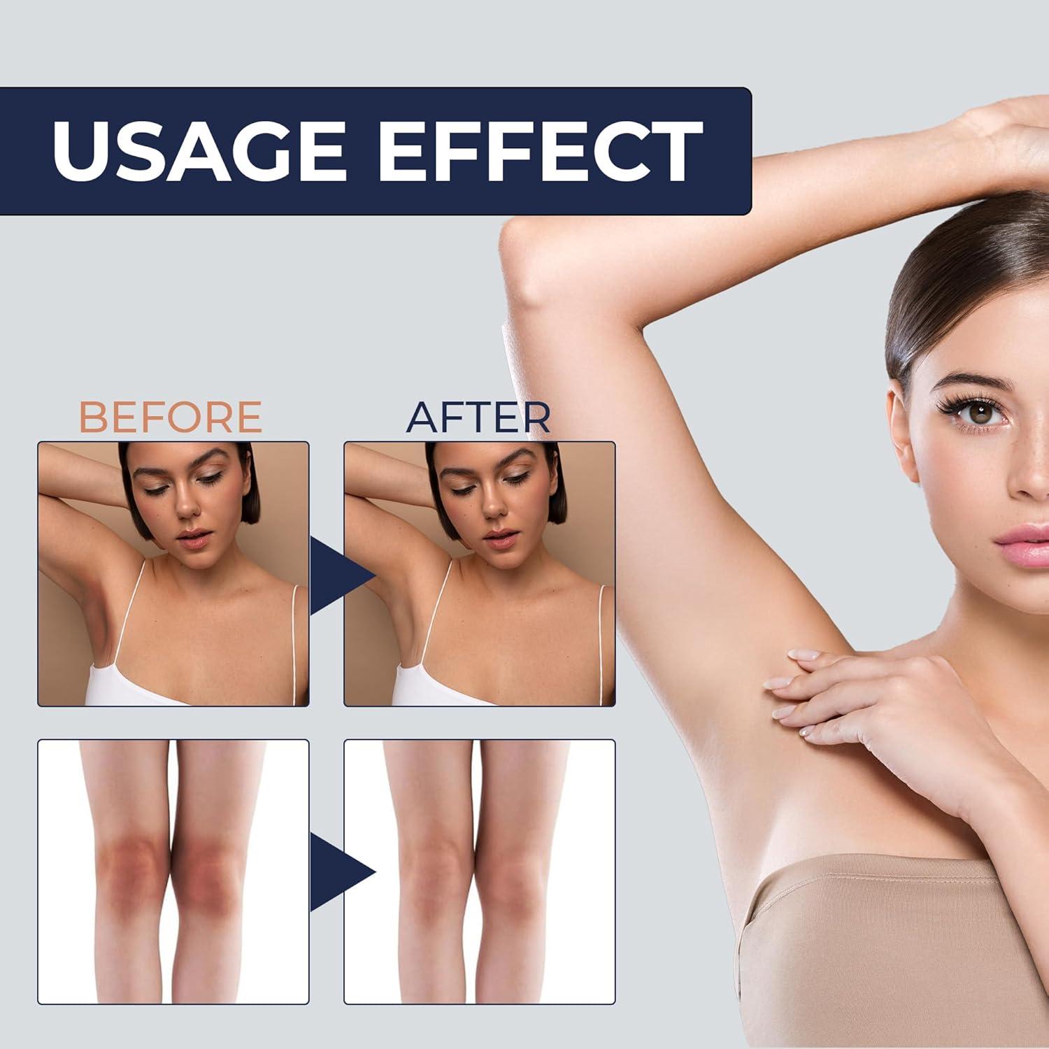 Dark Spot Remover Cream for Intimate Areas | Target Discoloration on ...