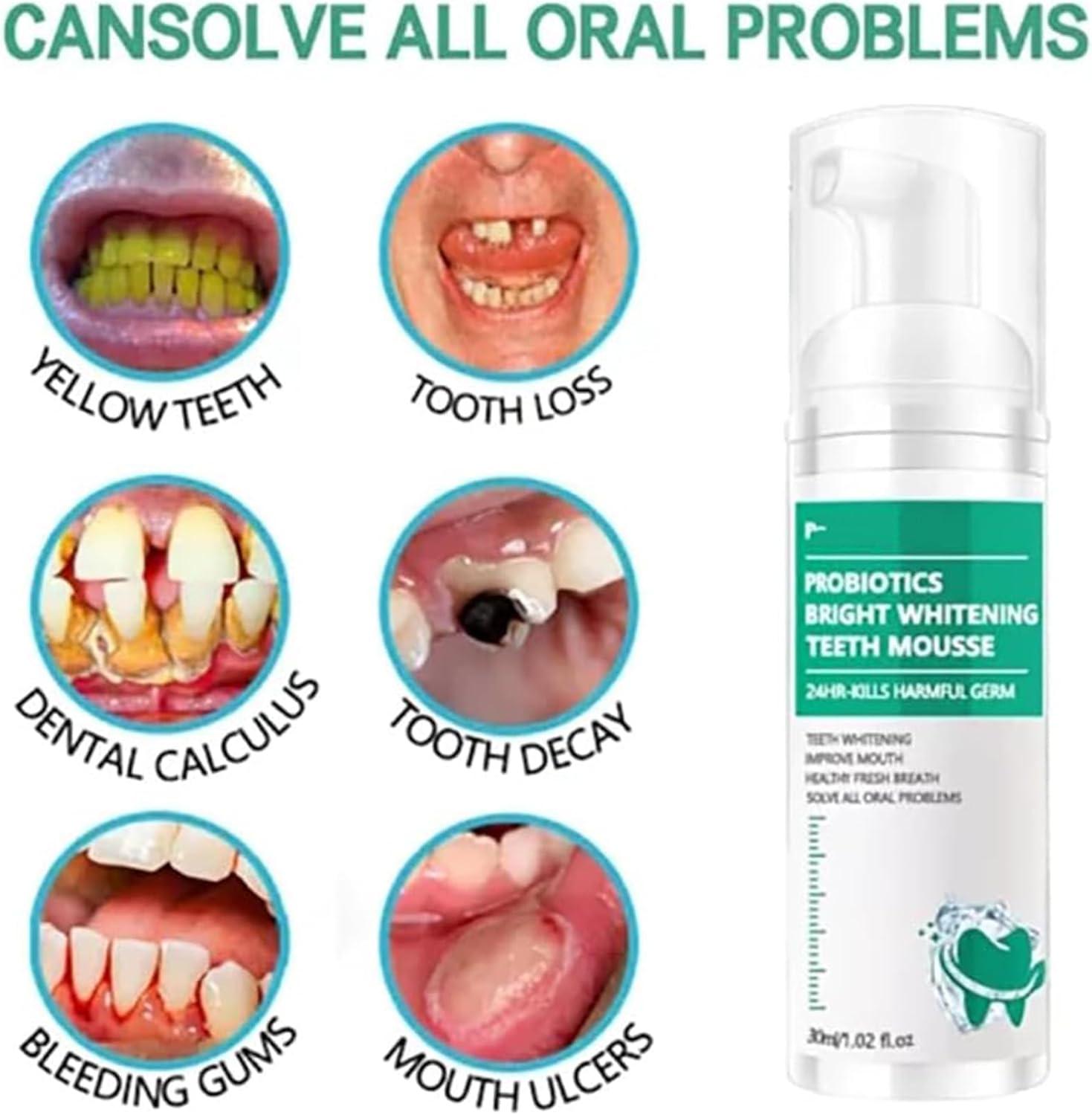 Lenaro Mousse - Lenaro Herbal Brightening Oral Repair Mousse Lenaro Probiotics Bright Whitening ...