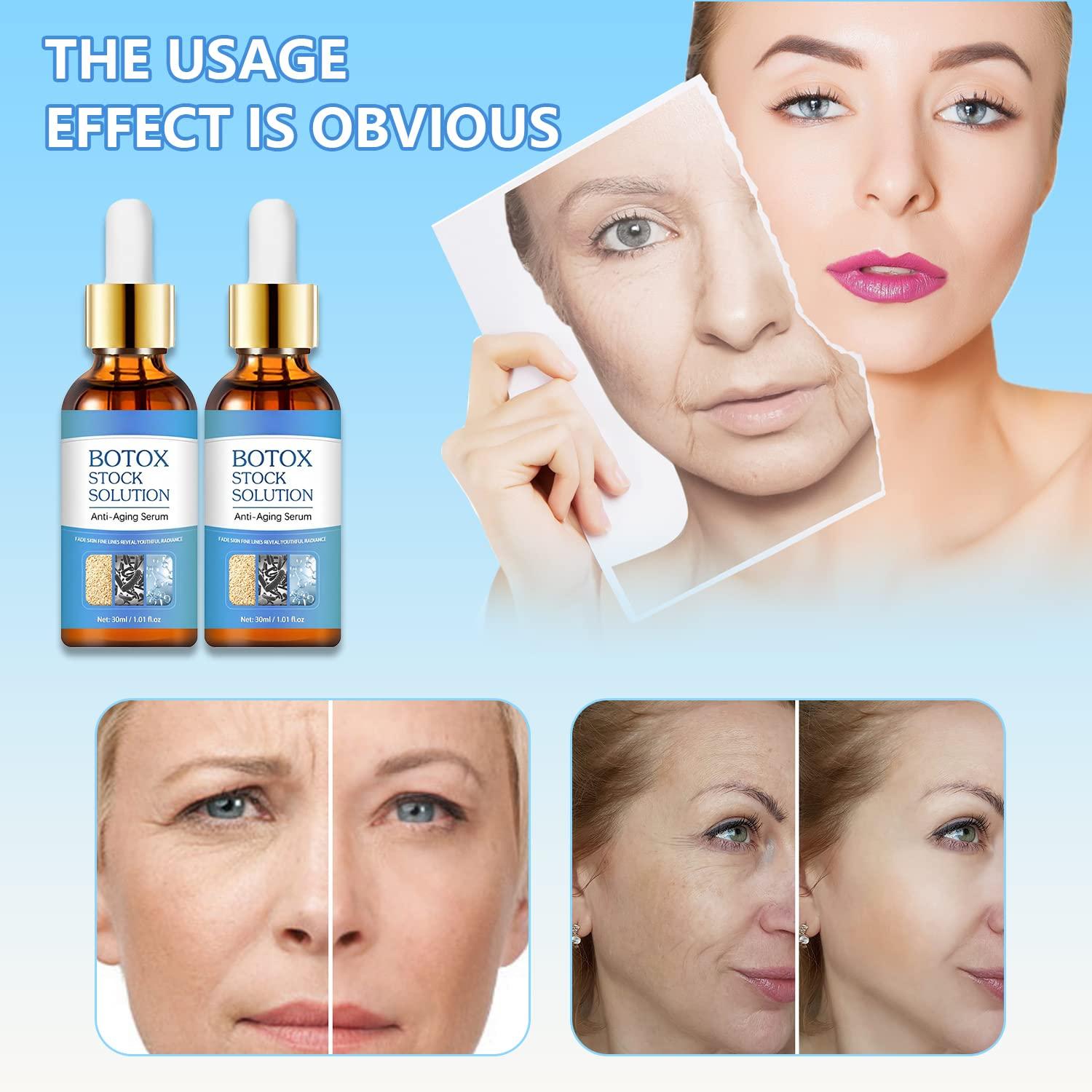 2023 Botox Stock Facial Solution + Jennifer Aniston Anti-Aging Serum ...