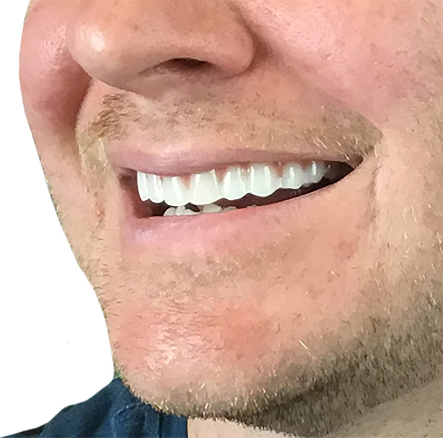 Instant Smile Comfort Fit Flex Upper Veneer - Natural Shade Cosmetic ...
