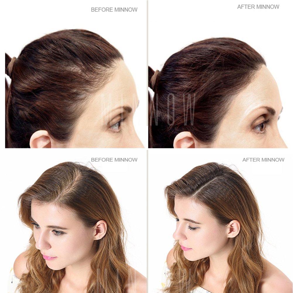 Natural Hair Loss Concealer - Hair Building Fibers for Men and Women 0 ...