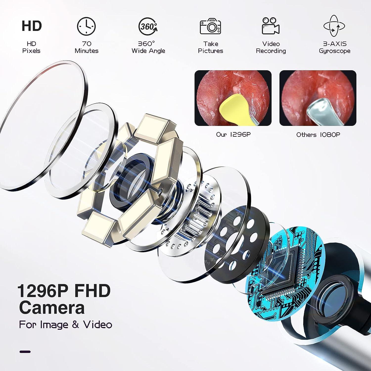 OTAONE Ear Wax Removal Tool with 1296P FHD Camera & Built-in WiFi - iOS ...