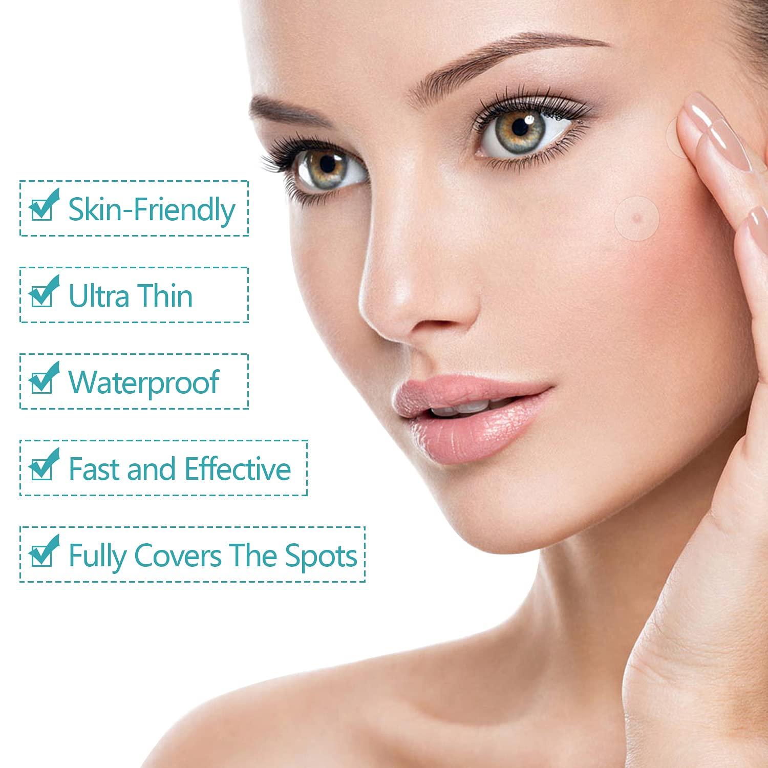 Acne Pimple Patches 180 Patches - Invisible Hydrocolloid Zit Patch for ...