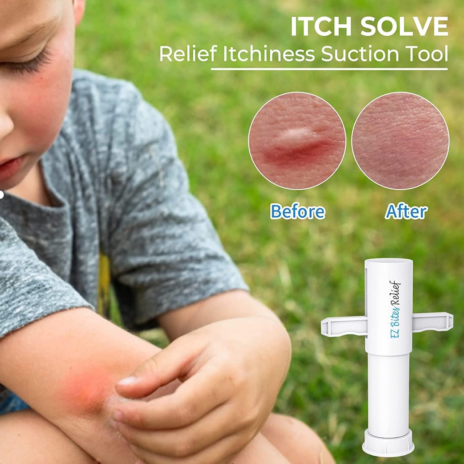EZ Bites Relief Venom Extractor 3-Pack - Bee Sting & Bite Suction Pump ...