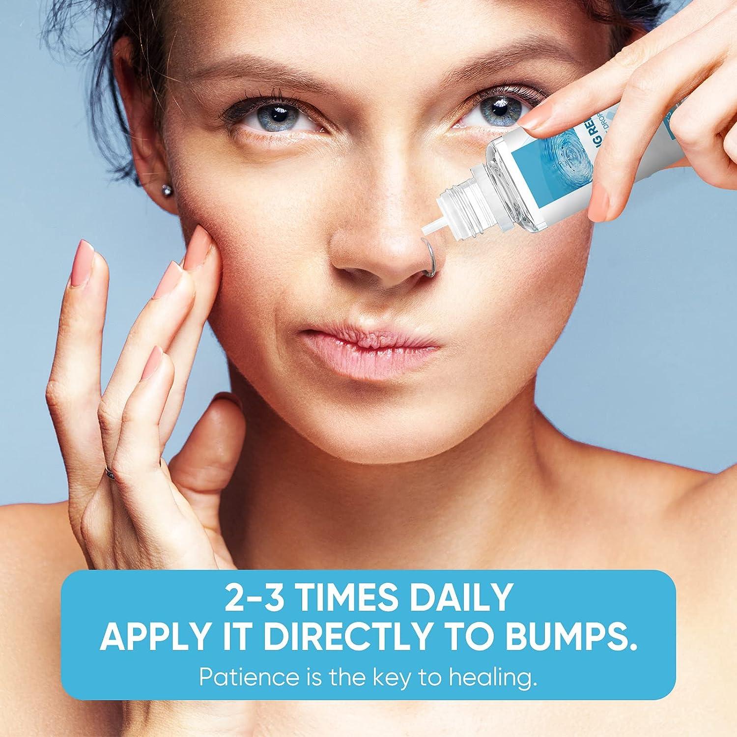 Keloid & Bump Treatment Drops - Piercing Aftercare for Scars, Healing ...