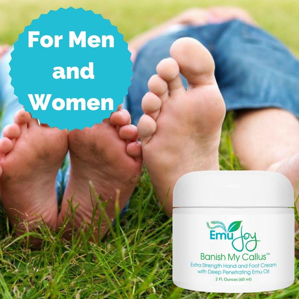 Callus Cream Hand & Foot Remover for Softening Rough Skin on Feet ...
