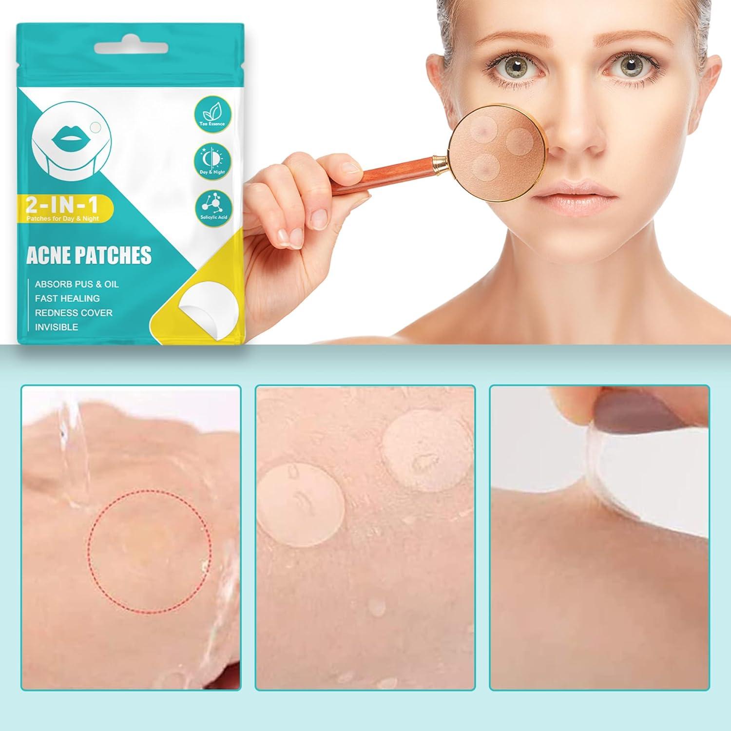 300 Pcs Invisible Hydrocolloid Pimple Patches with Tea Tree Oil ...