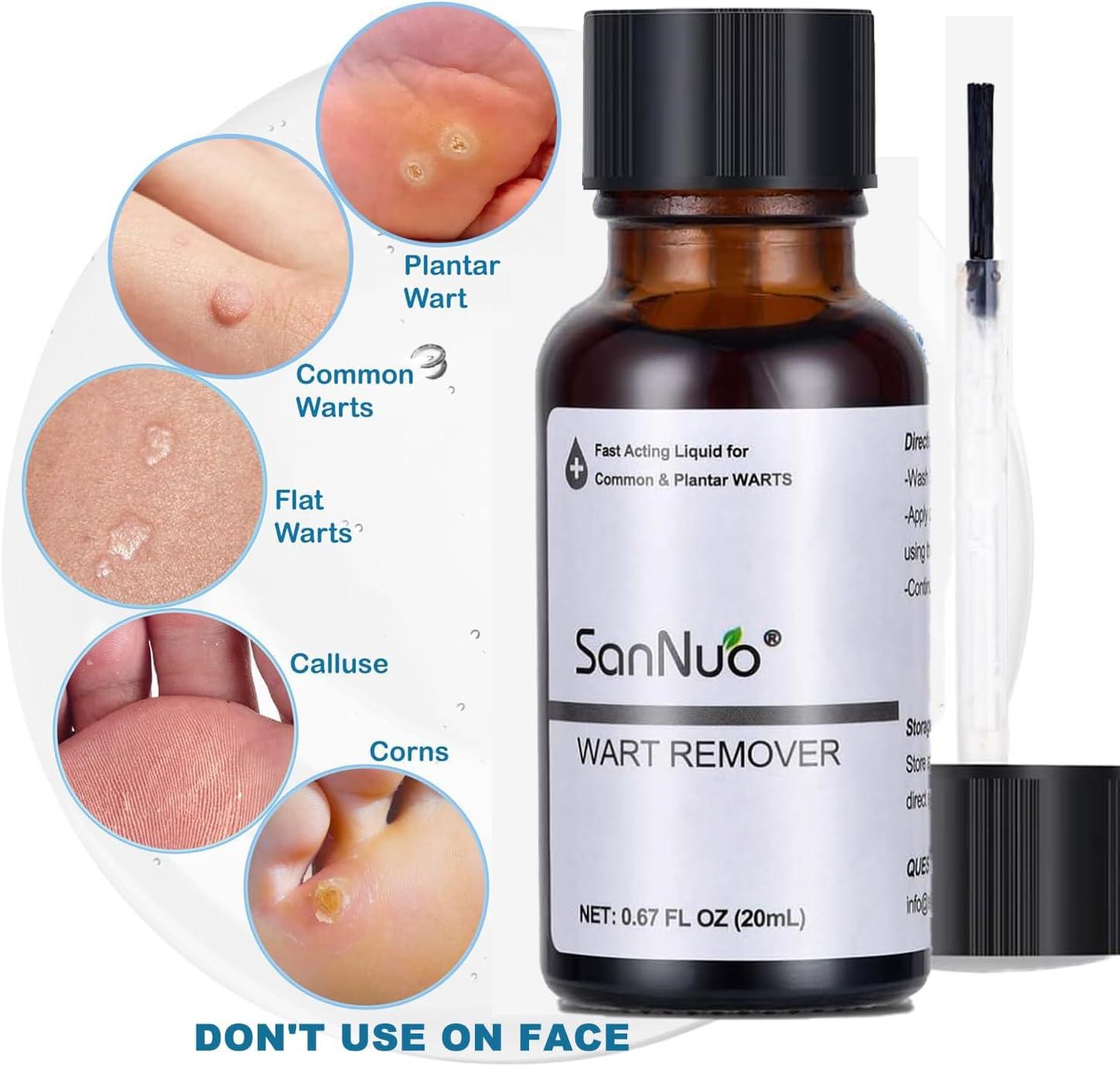 SANNUO Extra Strength Wart & Corn Remover Fast Acting Gel Wart Removal ...