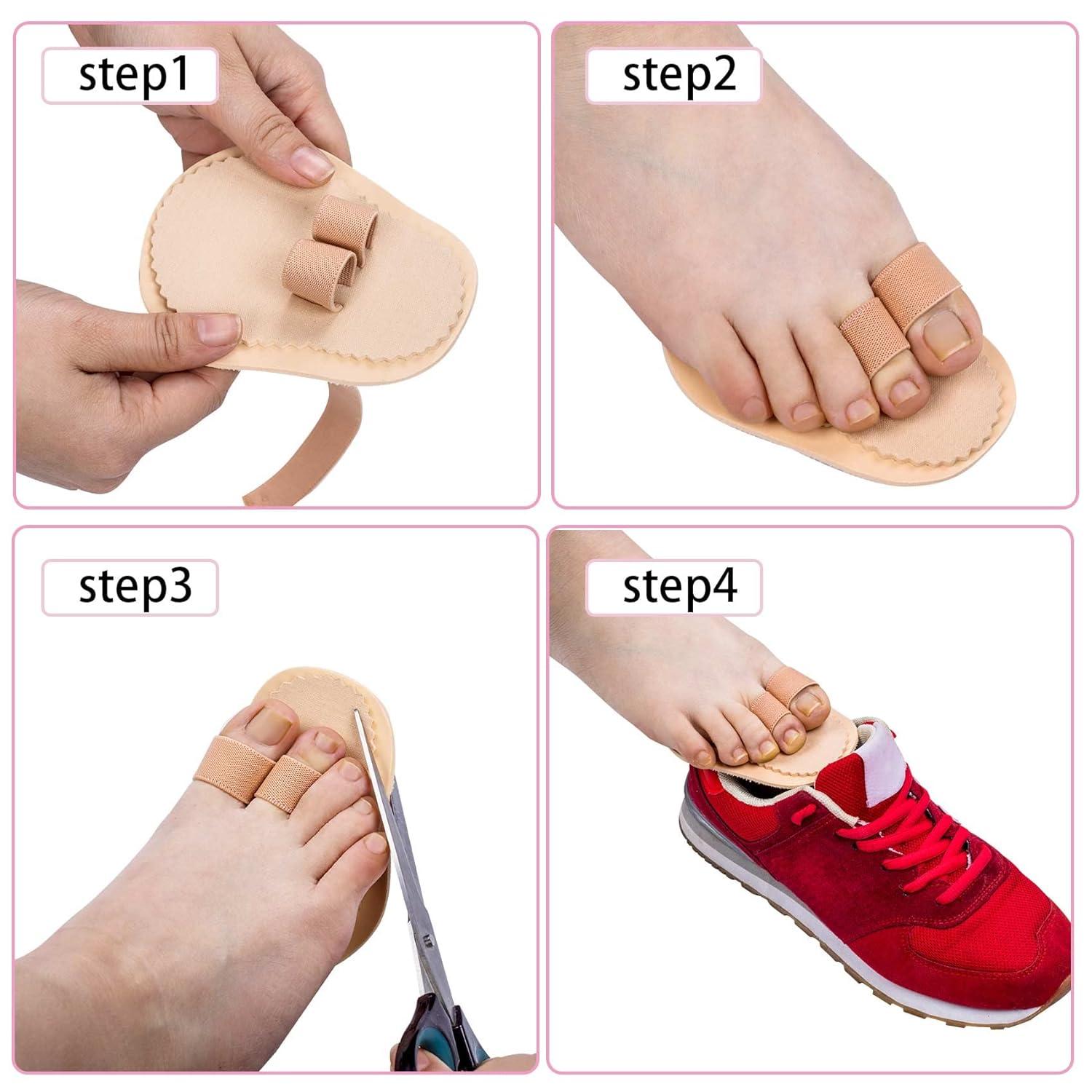ANCIRS 6 Pieces Toe Straightener Cushions Pads Toe Splint Regulator ...