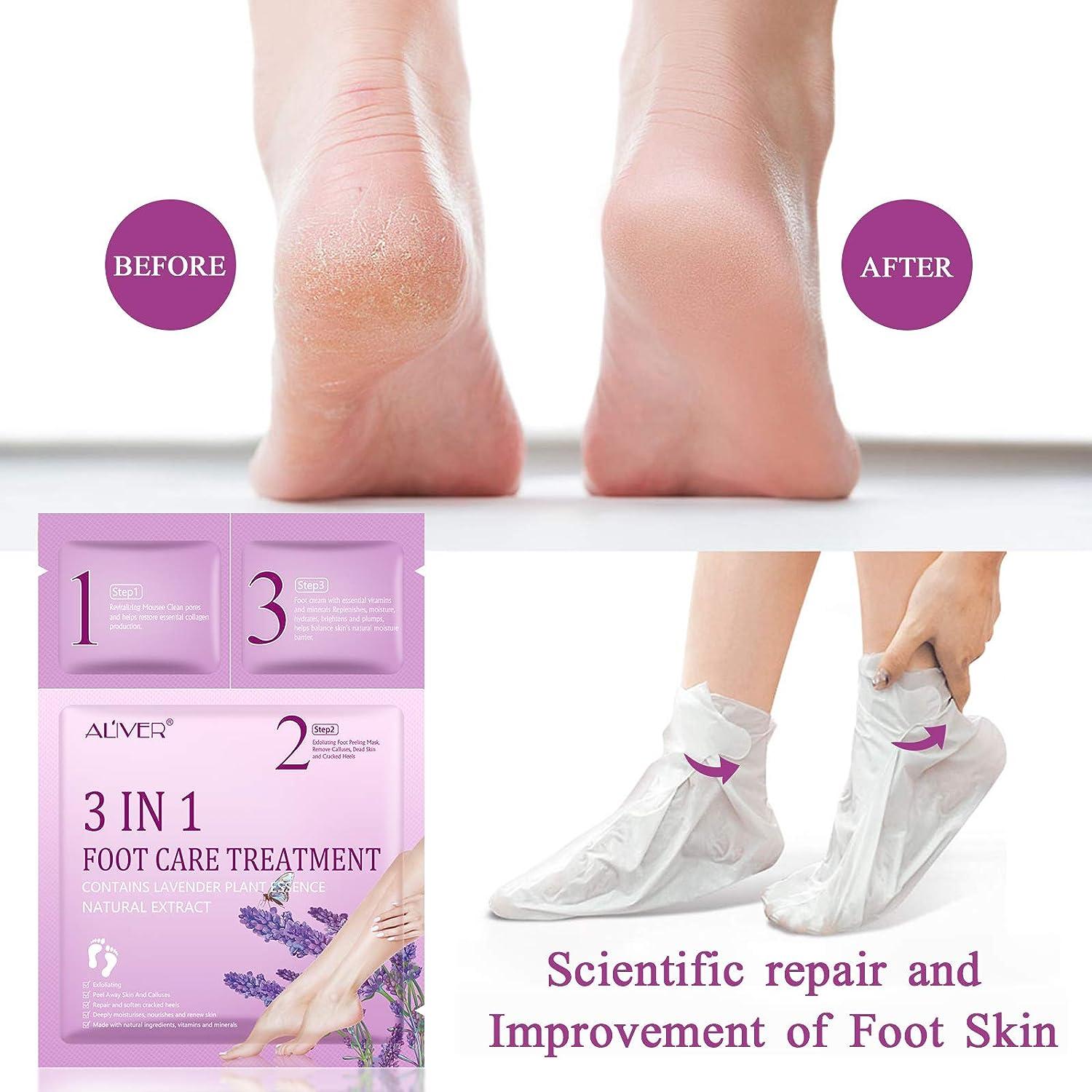 3 Pack Foot Peel Mask Foot Mask Removes Dead Skin & Calluses Natural ...
