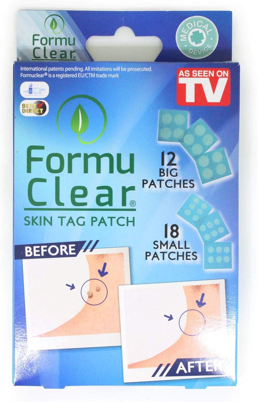 BEST DIRECT FormuClear Original Skin Tag As Seen On TV Box of 30 ...