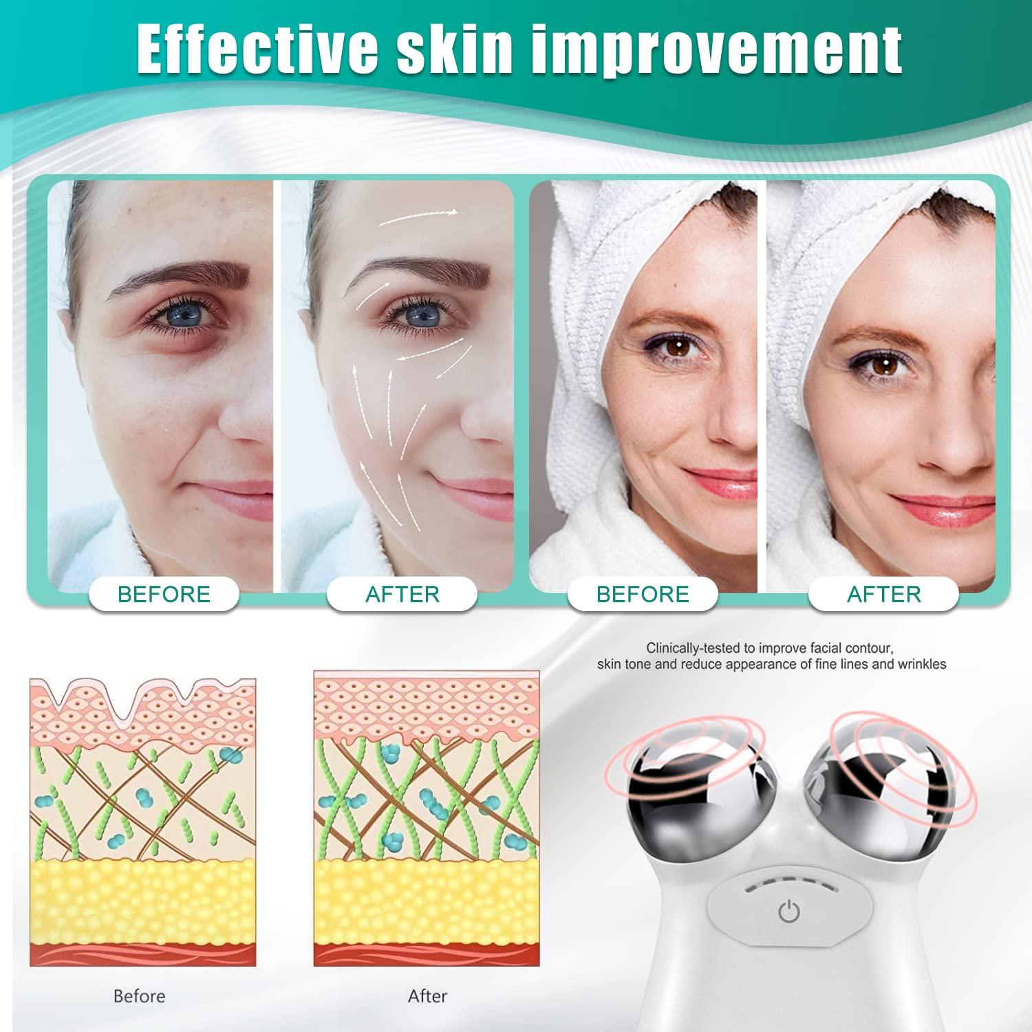 Microcurrent Face Roller for Lift and Skin Tightening | USB Mini ...