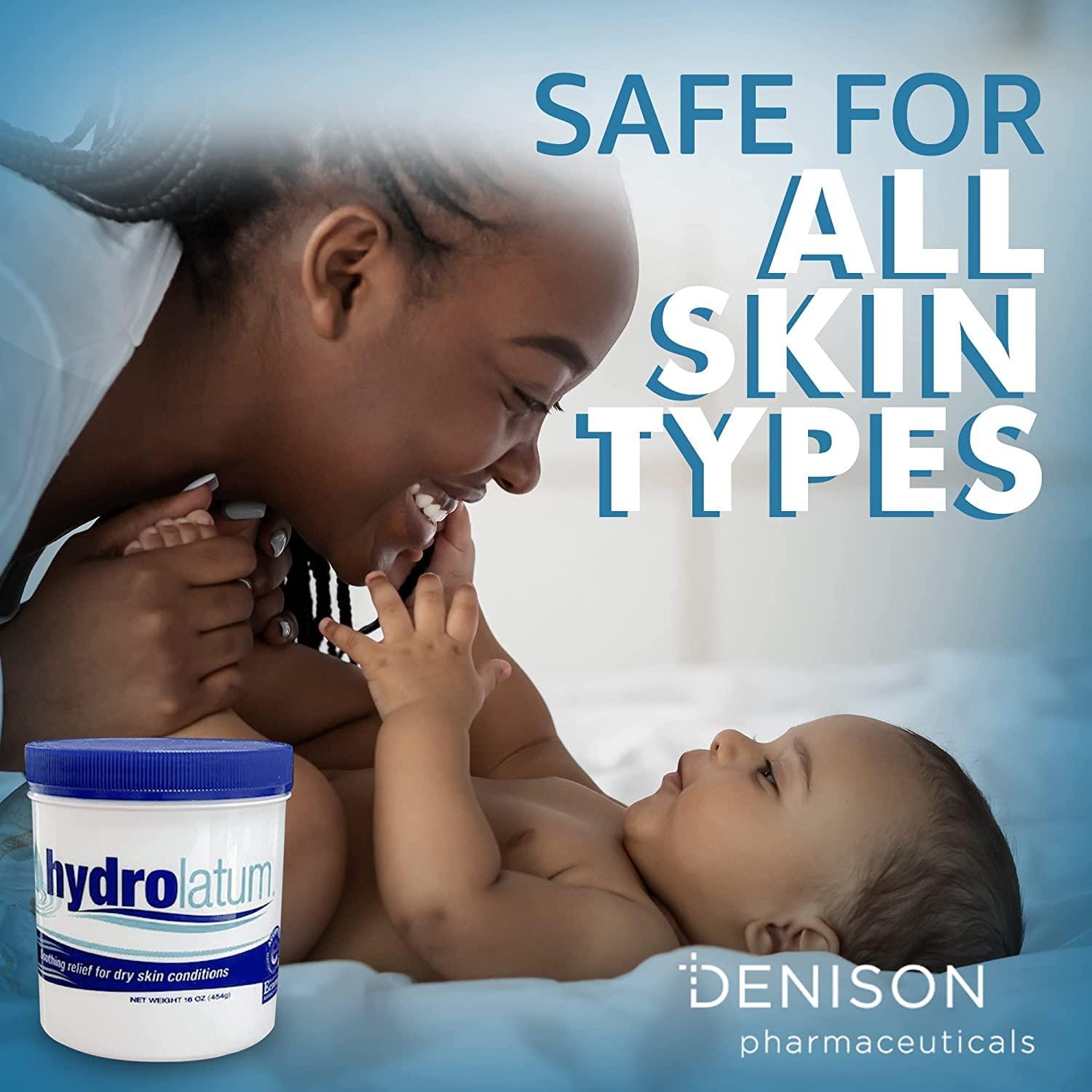 Hydrolatum Dry Skin Cream 1lb & 2oz - Eczema & Psoriasis Treatment ...