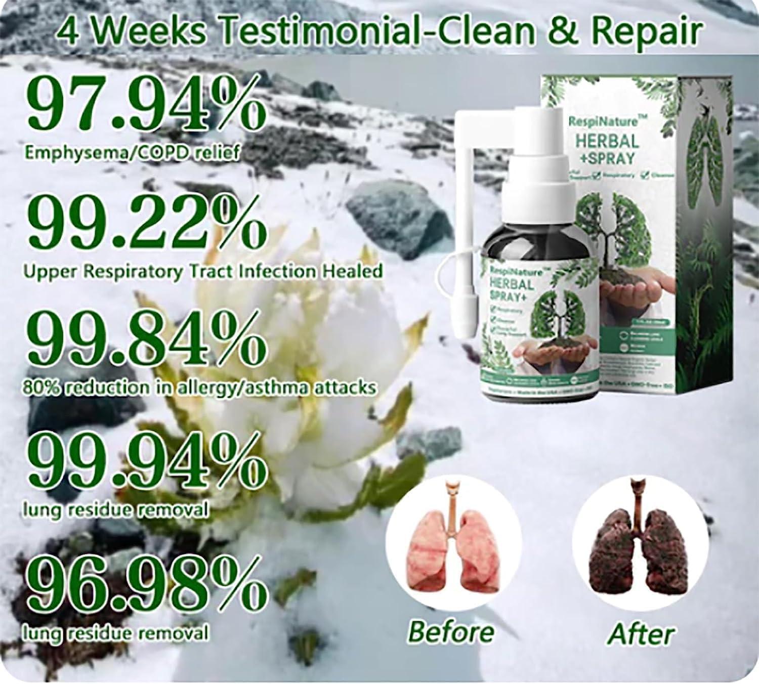 Stadsweg Respinature Herbal Lung Cleanse Mist-Powerful Lung Support ...