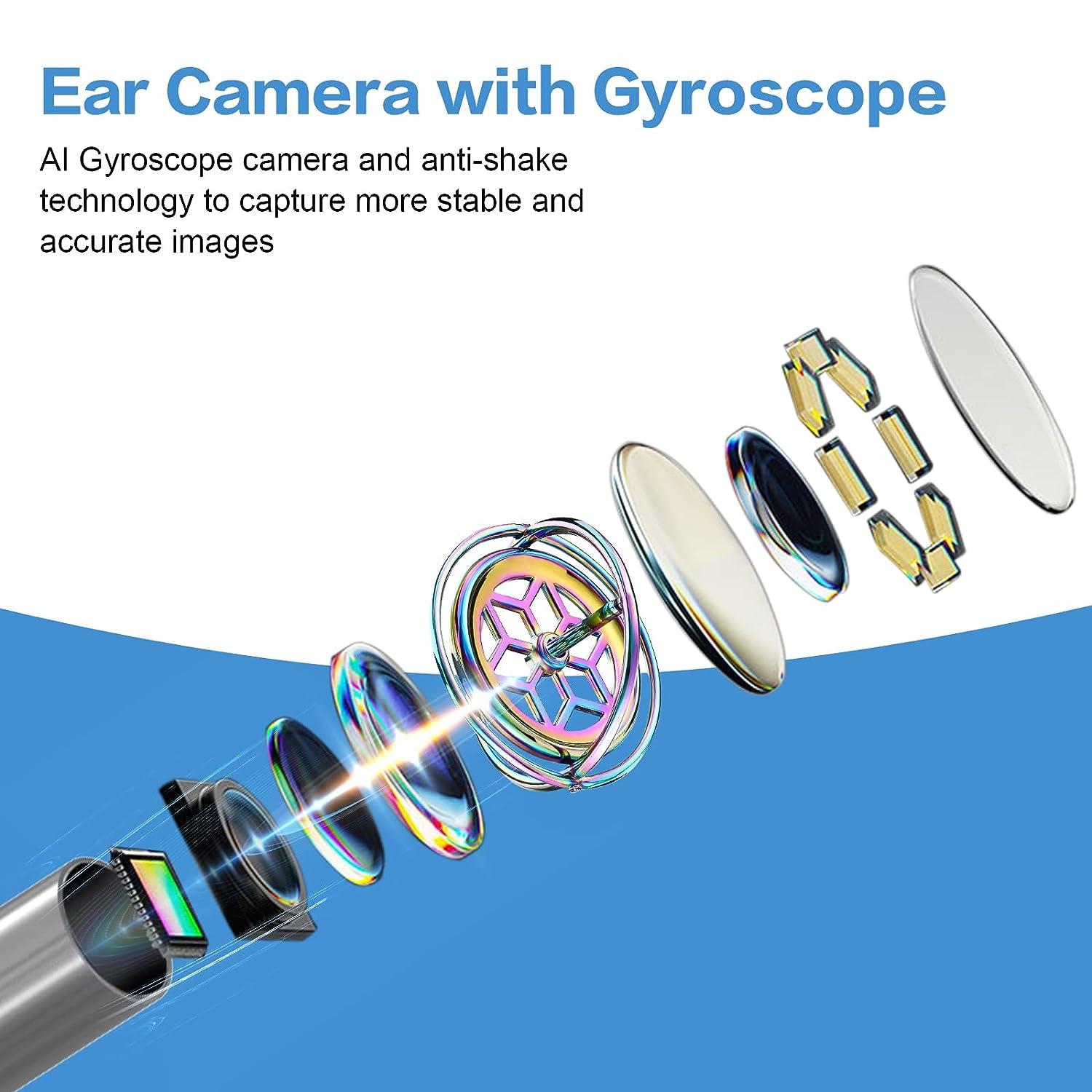 AI Intelligent Visual Digital Otoscope Hiacinto | Ear Wax Removal Tool ...