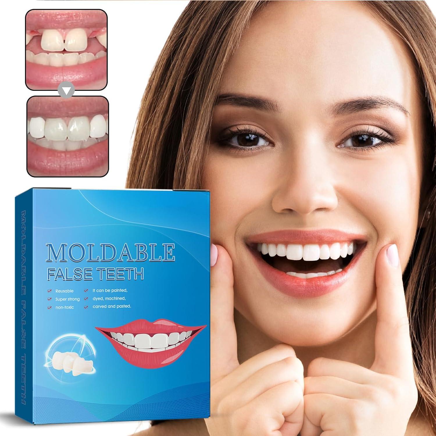 Tooth Repair Kit - Dentures Dental Adhesive Set | Temporary Veneers ...