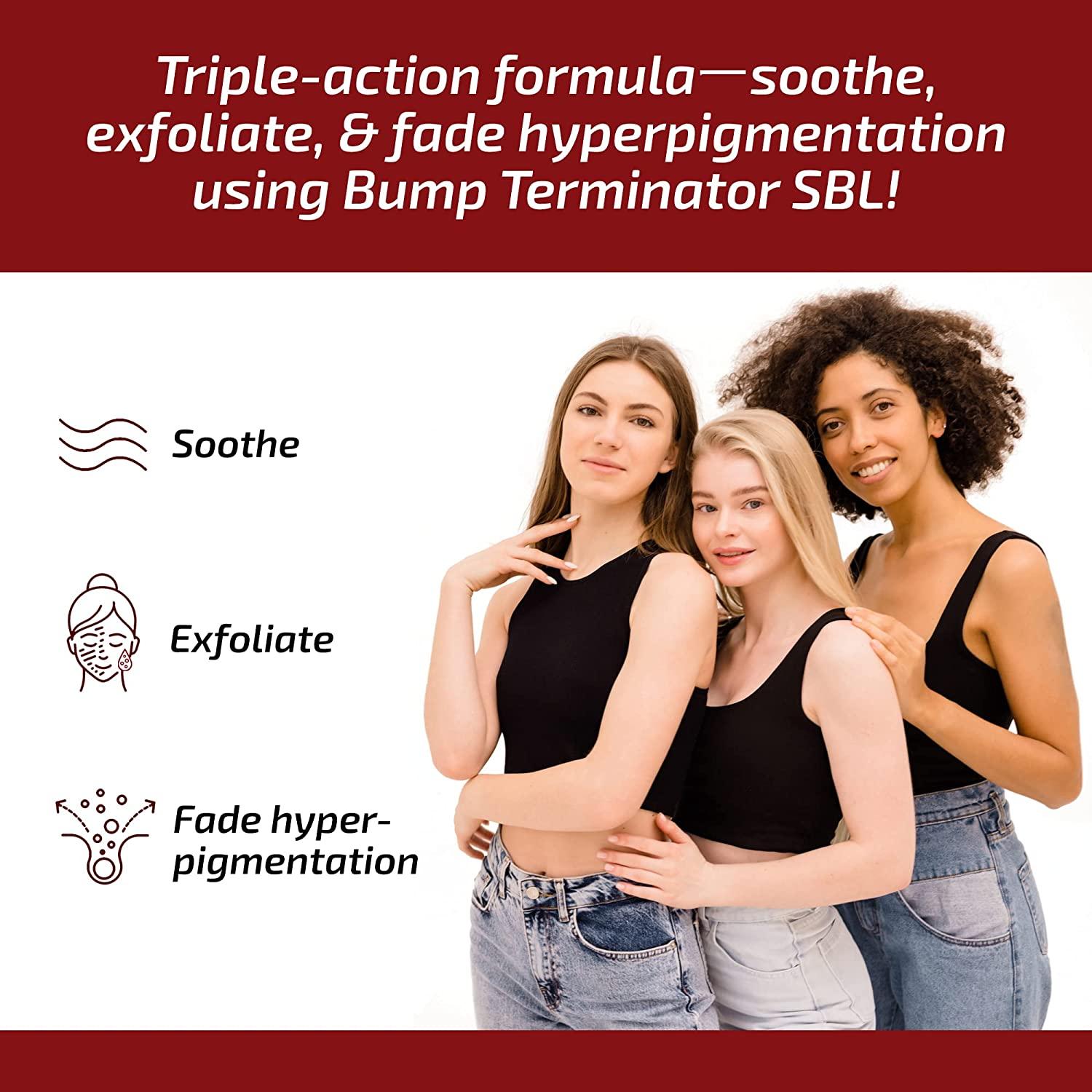 Bump Terminator Severe Bumps Lotion (4oz) - Fast Relief for Razor Bumps ...