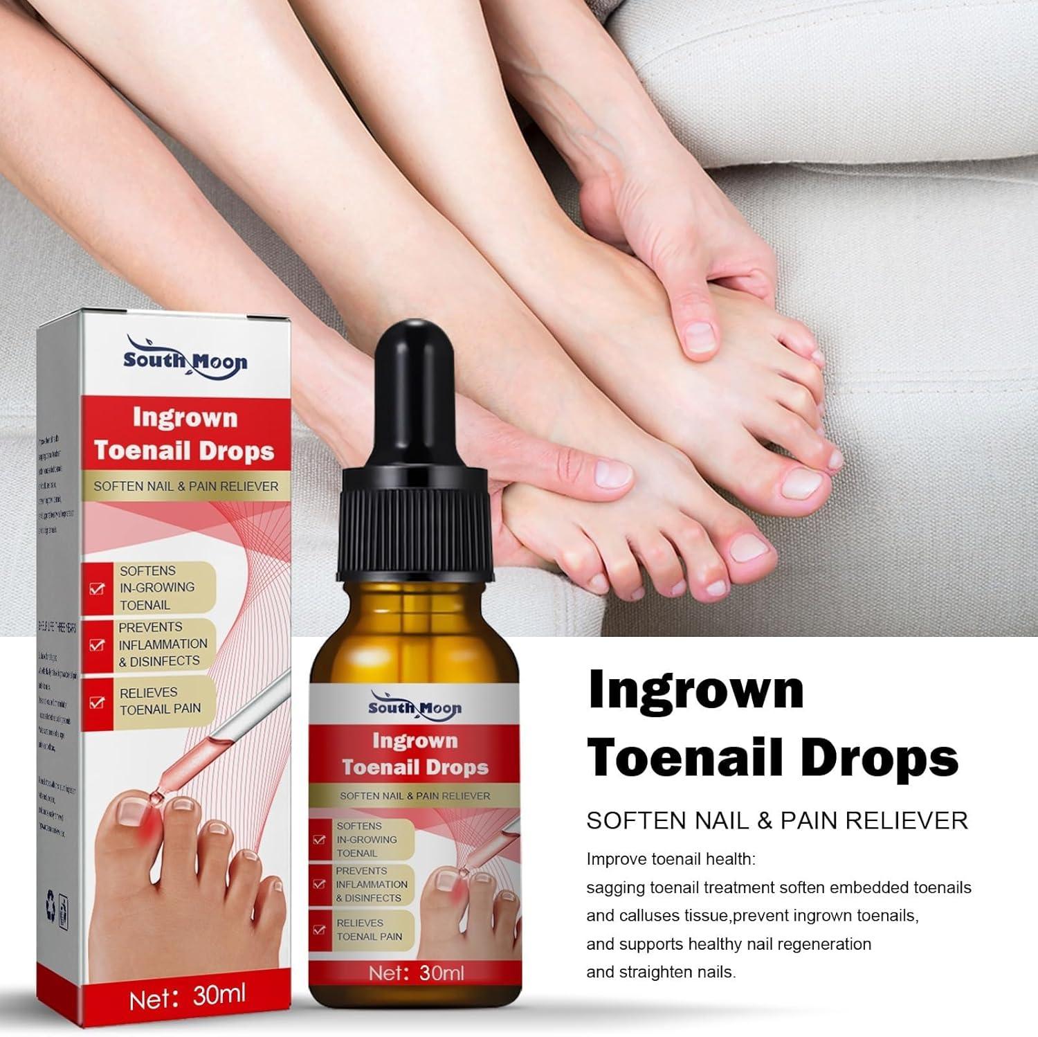 VIDIND Ingrown Toenail Correction Oil Ingrown Toenail Correction Drops ...