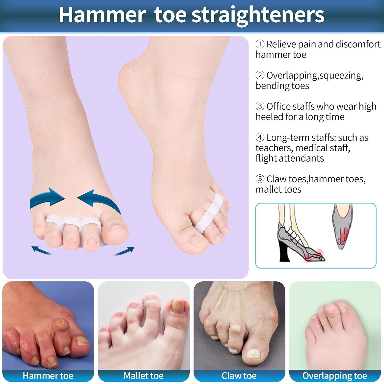 DYKOOK Hammer Toe Straightener Set - 6 PCS Toe Corrector Gels for ...
