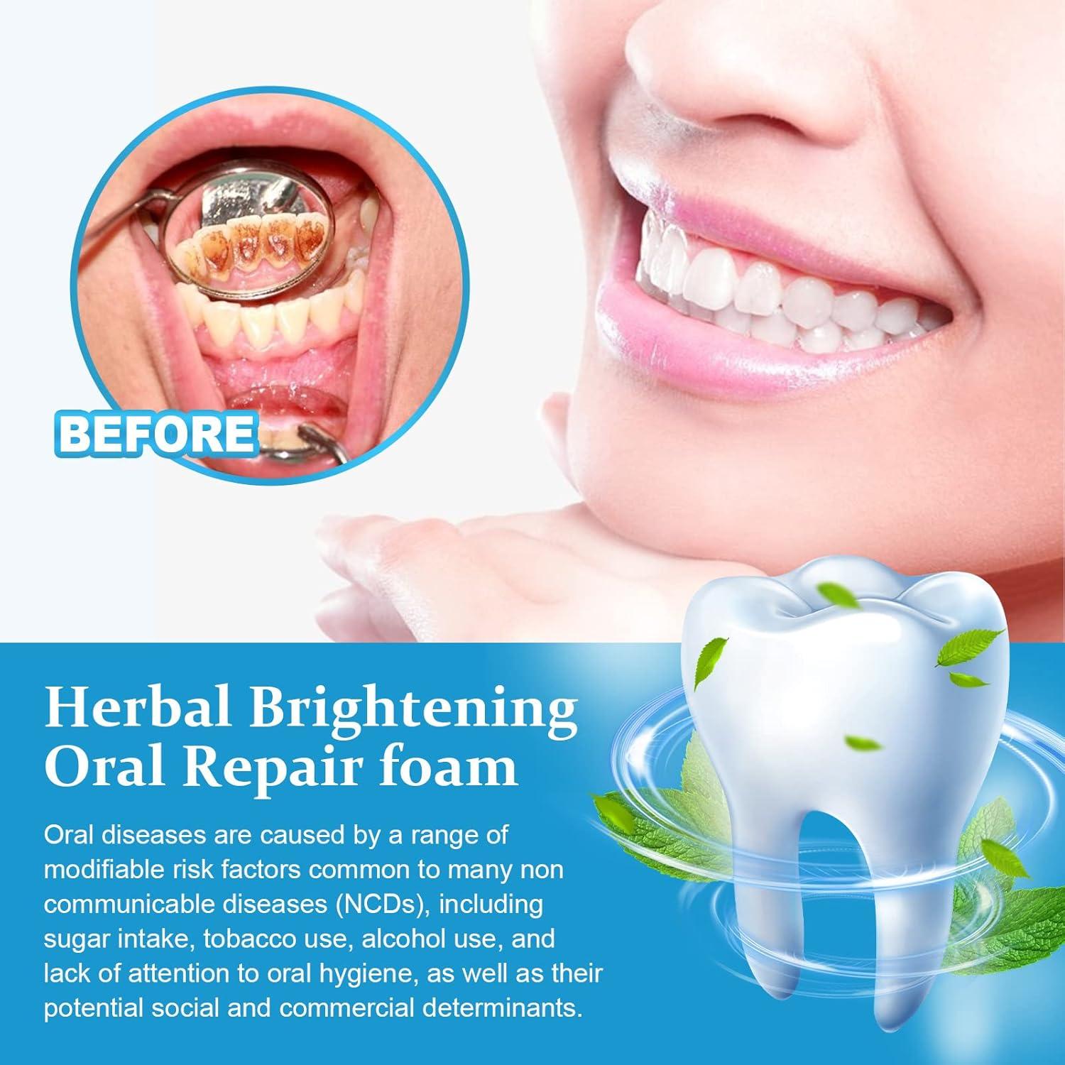 Herbal Brightening Oral Repair Foam - Whitening Foam Toothpaste (1pcs ...