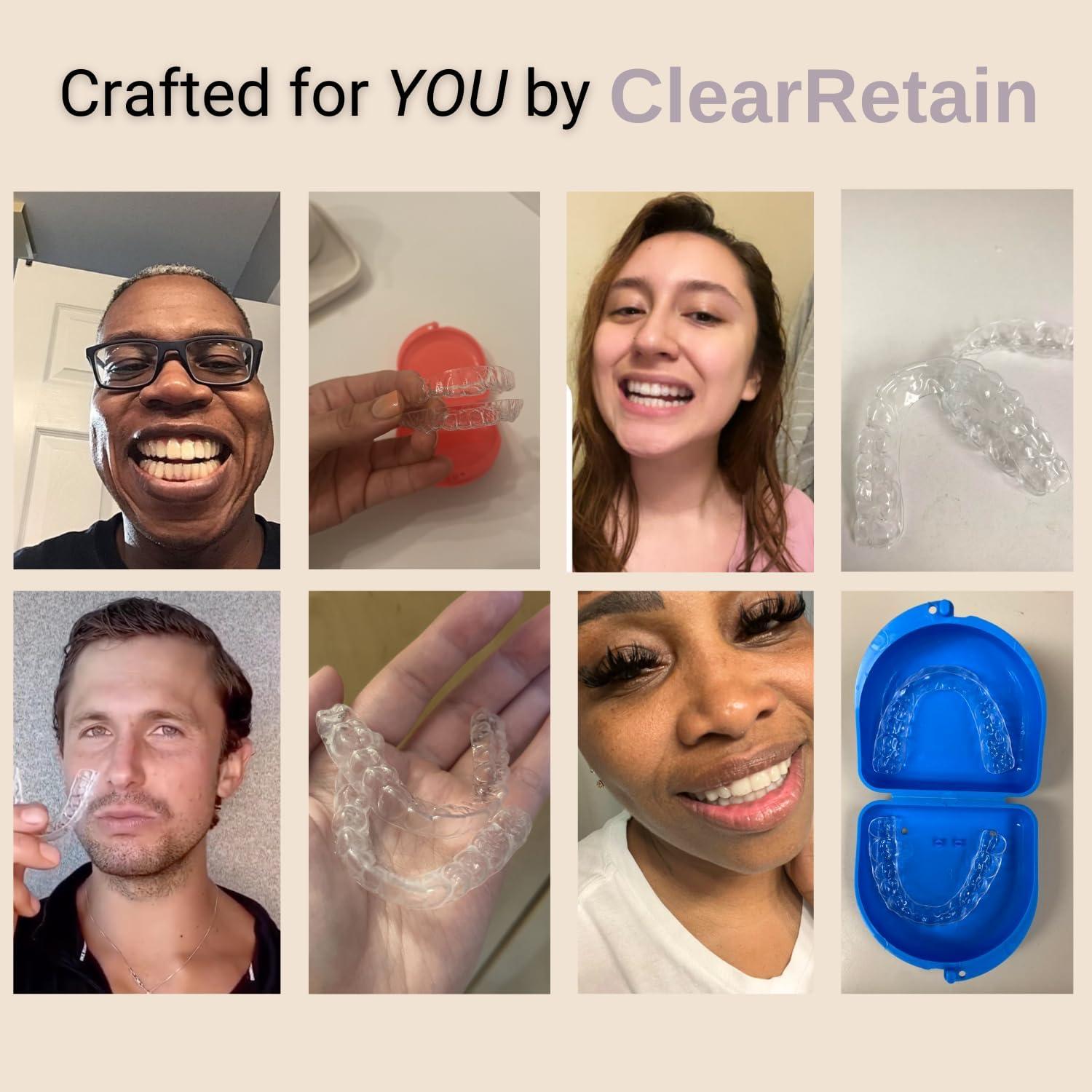 Custom Clear Dental Retainers | At-Home Kit for Perfect Fit ...