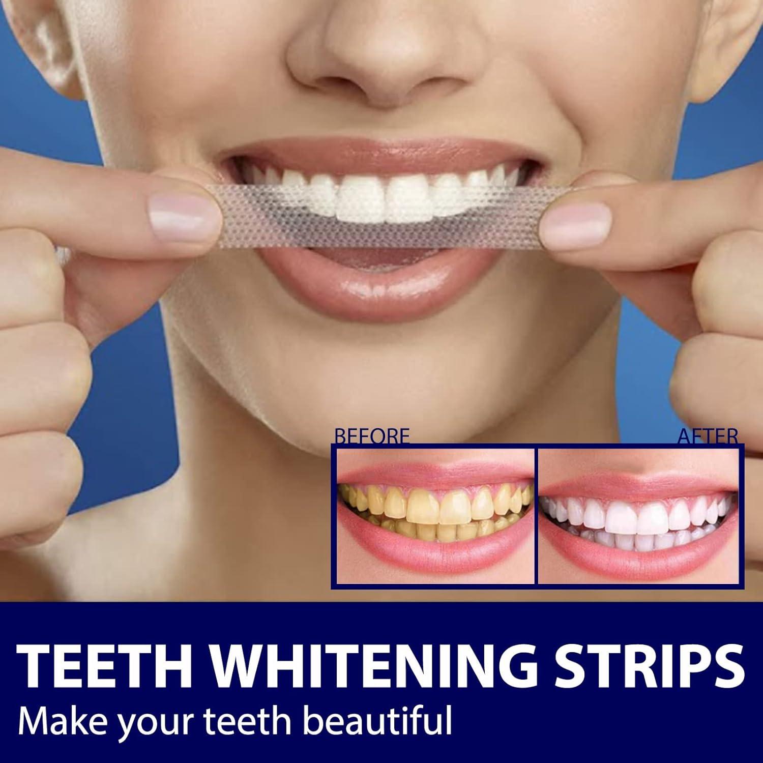 Tooth Whitening Strips - 28 Mint Flavored Strips for Effective Teeth ...