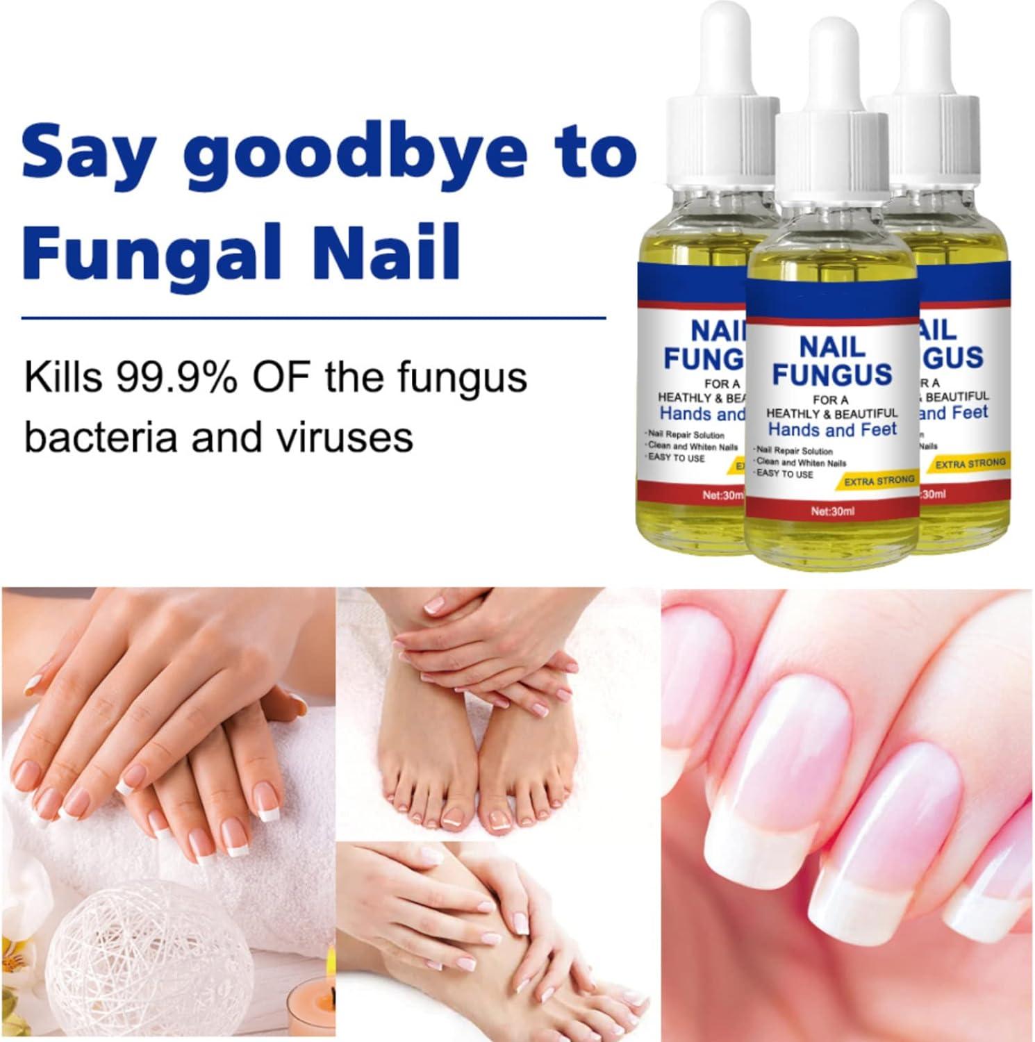 Extra Strong Nail Fungal Treatment Set for Damaged Toenails & Fingernails - Anti Fungus Nail ...