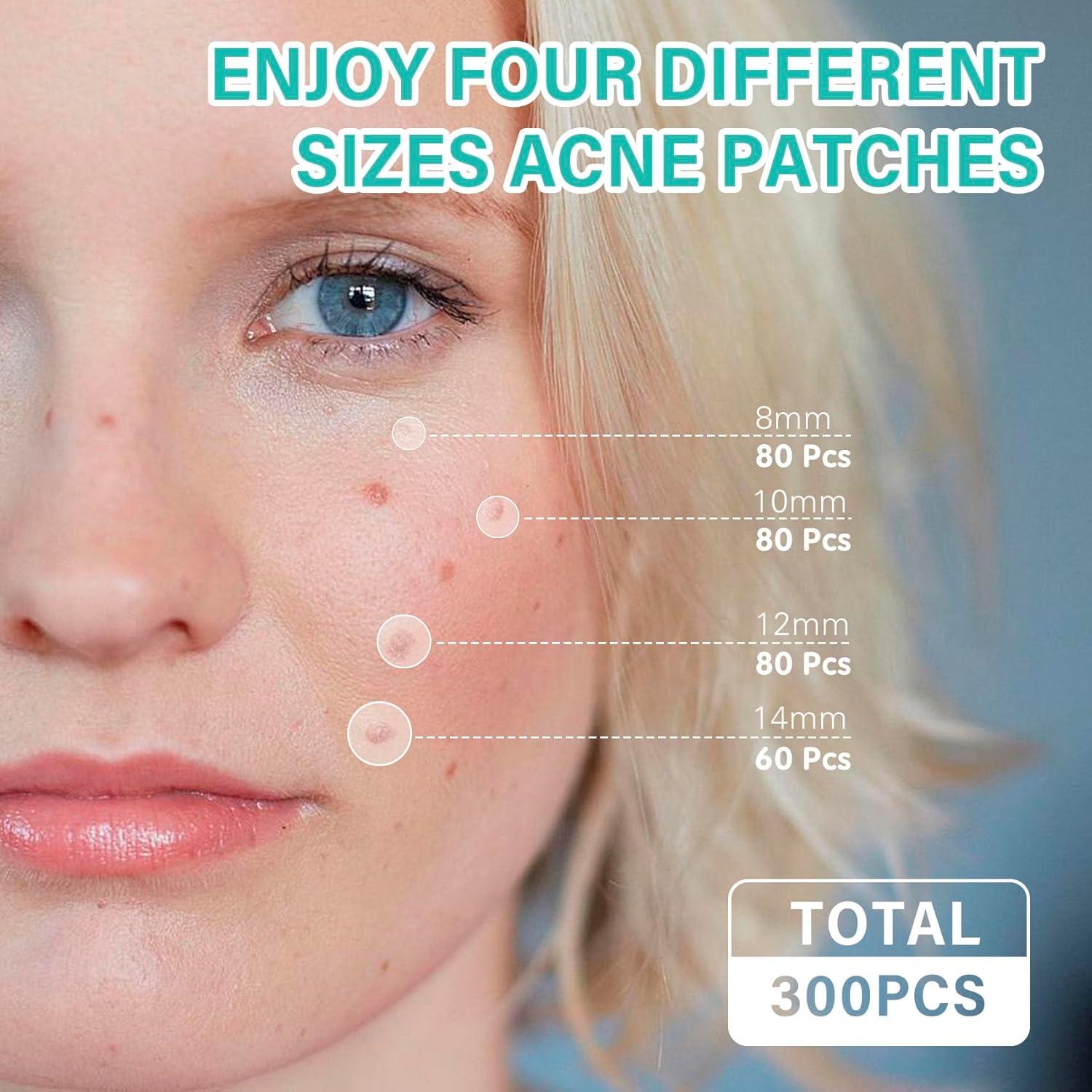 Pixline Pimple Patches - 300 Count Tea Tree Oil & Salicylic Acid Acne ...