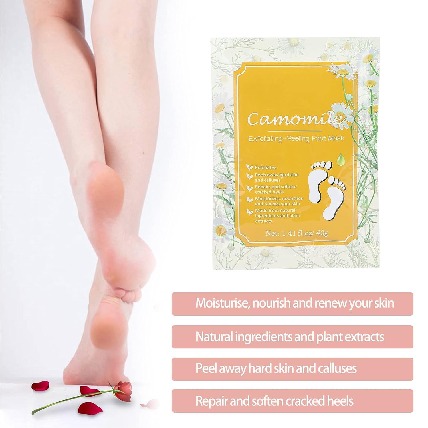 Foot Peeling Mask - Nourishing Treatment for Dry Cracked Skin | 40g ...