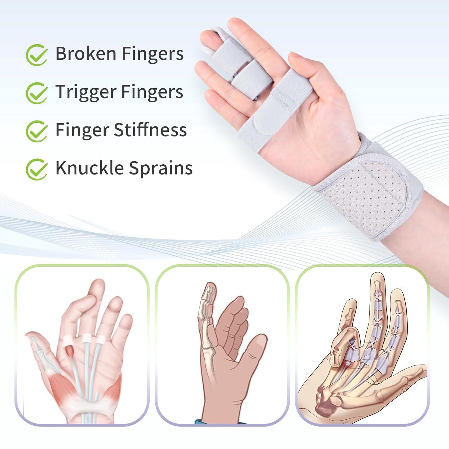 Buy Trigger Finger Splint & Finger Brace | Joint Stabilizer & Hand ...